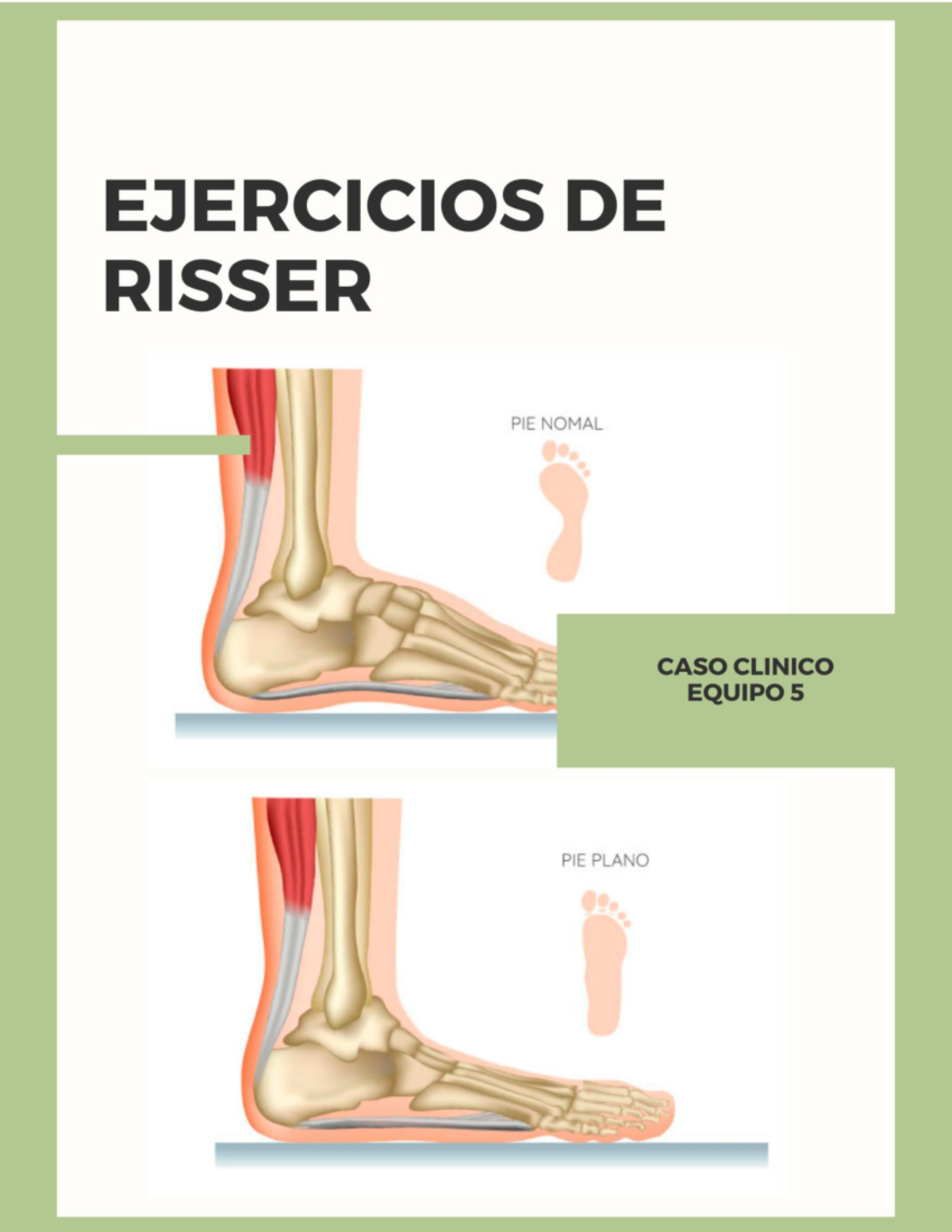 Caso clinico 5 pie plano - 2 Caso clÌnico. Ejercicios de Risser Morales ...