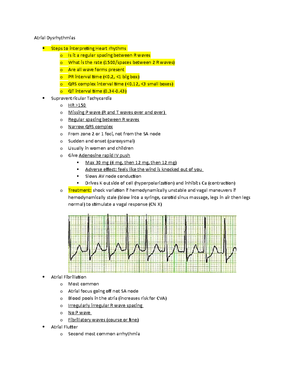 Exam 3 study guide - N/A - Atrial Dysrhythmias Steps to interpreting ...