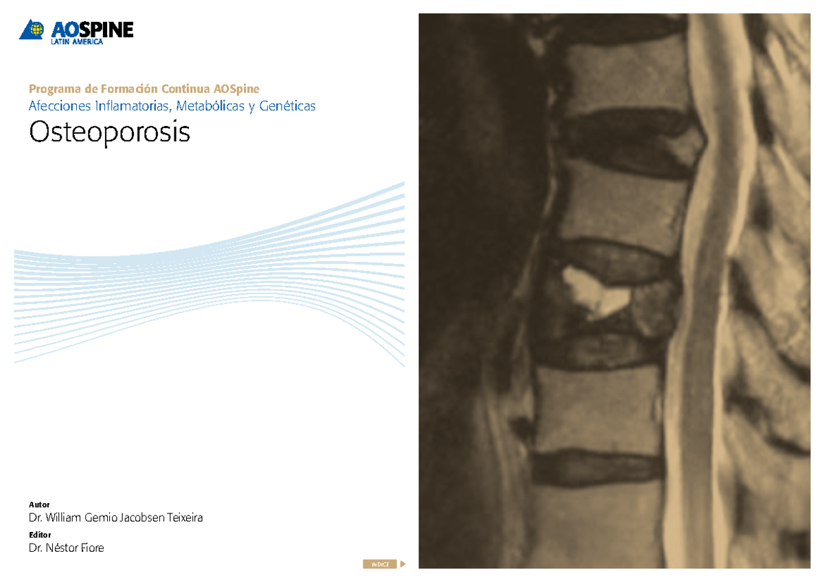 Osteoporosis - Programa de Formación Continua AOSpine Afecciones ...