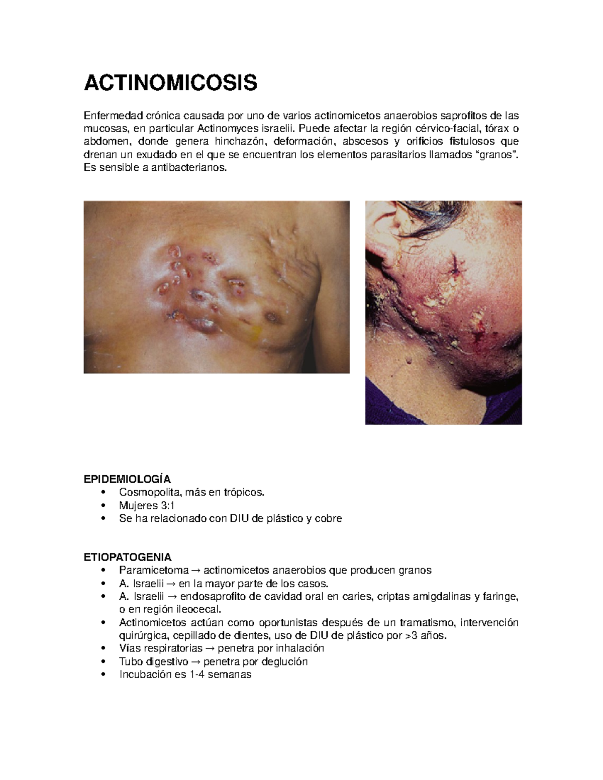 Actinomicosis - Resumen Dermatología - ACTINOMICOSIS Enfermedad causada por uno de varios - Studocu