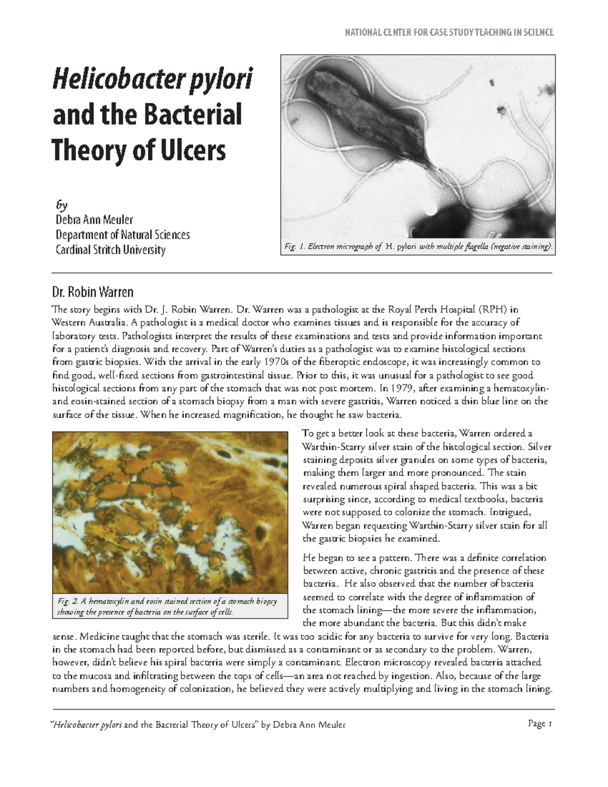 Bacterial theory of ulcers - Case study - READ AND Bring THIS TO YOUR ...