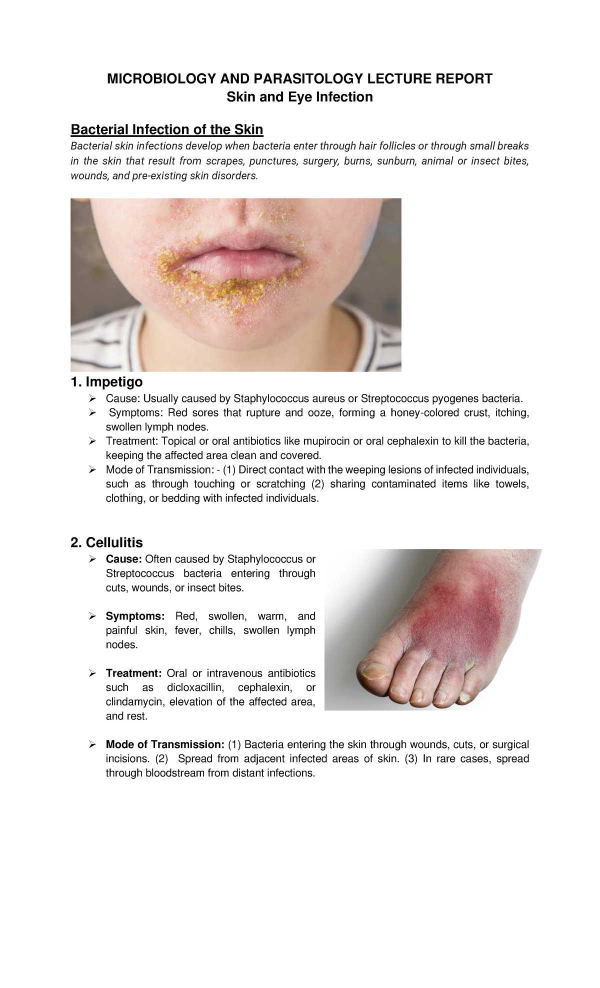 G2 Summary SKIN AND EYE Infections Final TERM - MICROBIOLOGY AND ...