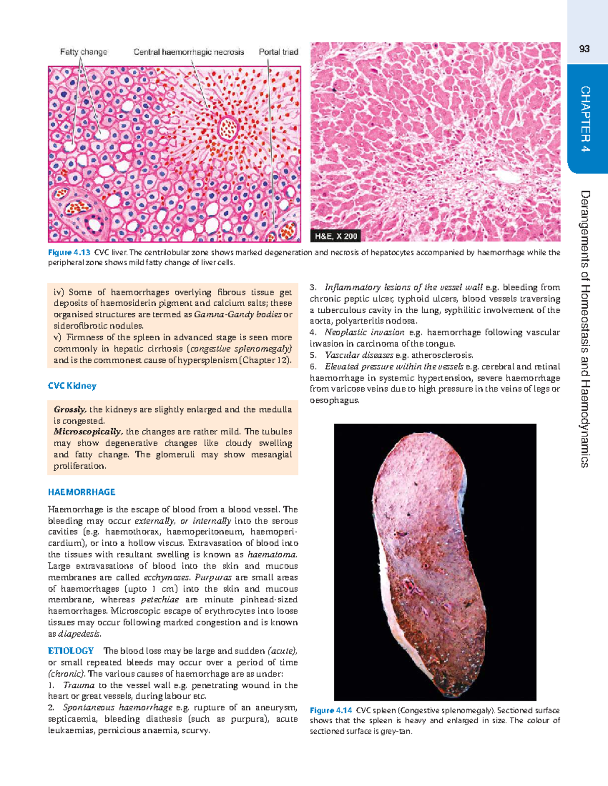 Harsh Mohan Textbook of Pathology, 7th edition-13 - 93 Derangements of ...