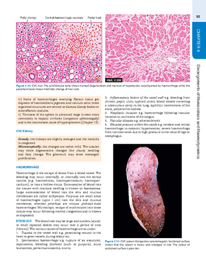Harsh Mohan Textbook of Pathology, 7th edition-22 - General Pathology ...