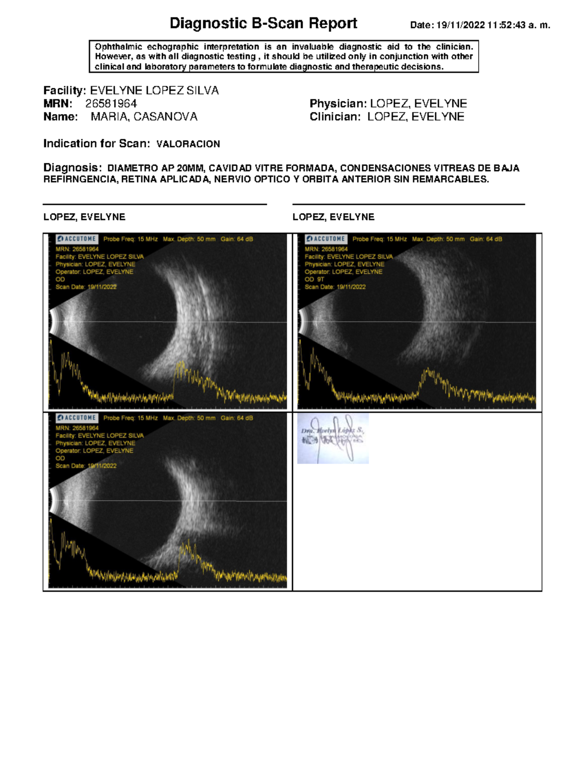 Maria, Casanova Bscan Reports - Diagnostic B-Scan Report Date: 19/11 ...