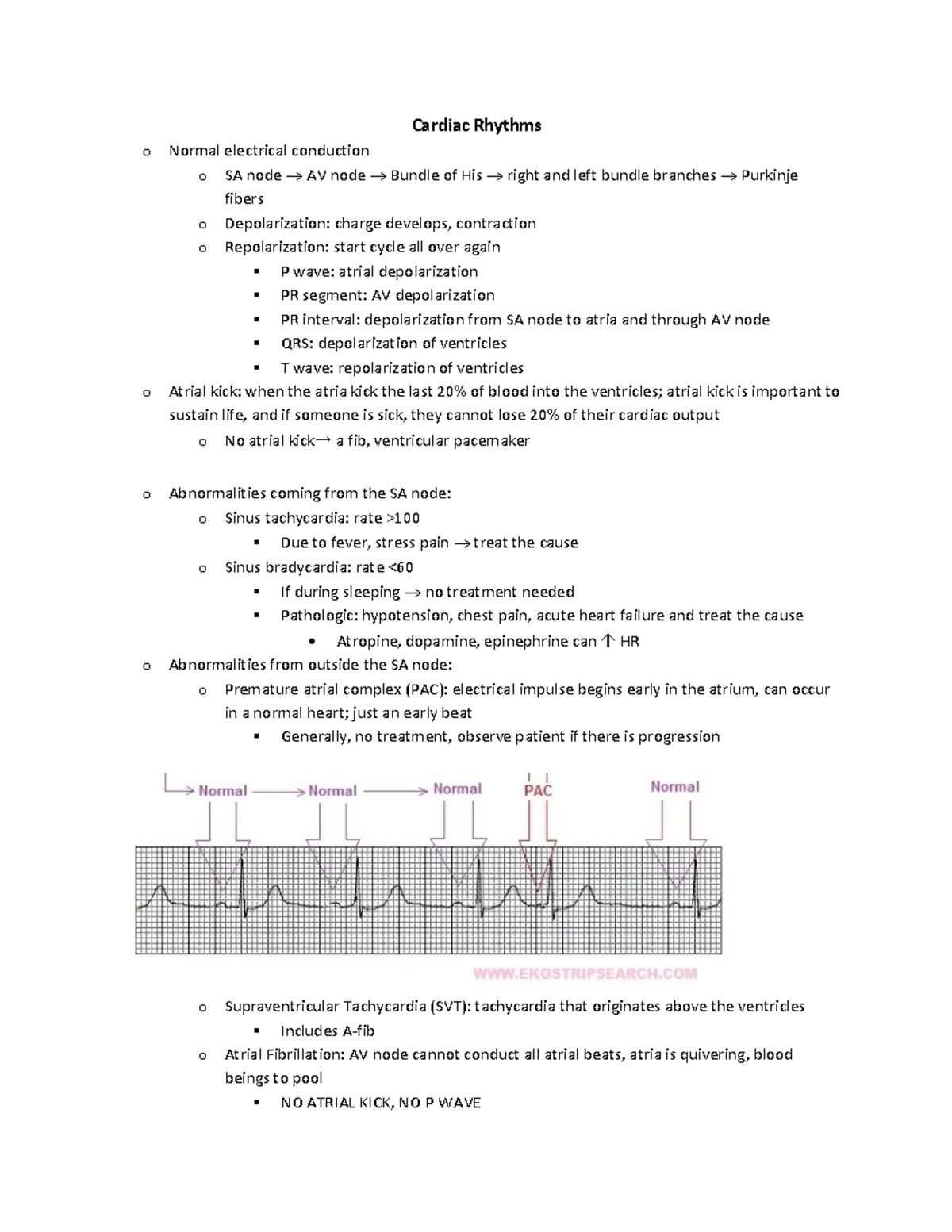 Cardiac Study Guide - Cardiac Rhythms o Normal electrical conduction o ...