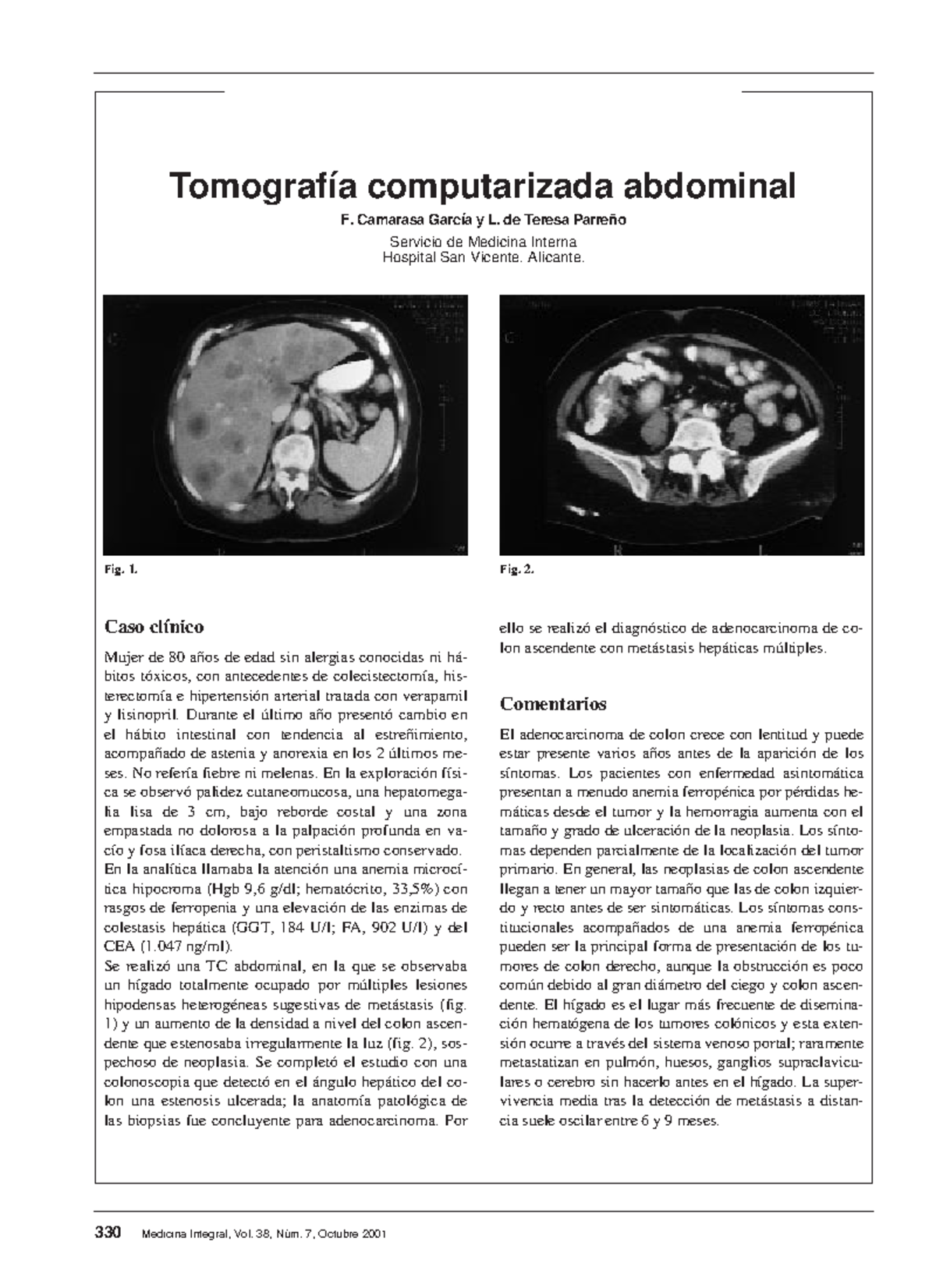 13022691 - Hsjsj - 330 Medicina Integral, Vol. 38, Núm. 7, Octubre 2001 ...