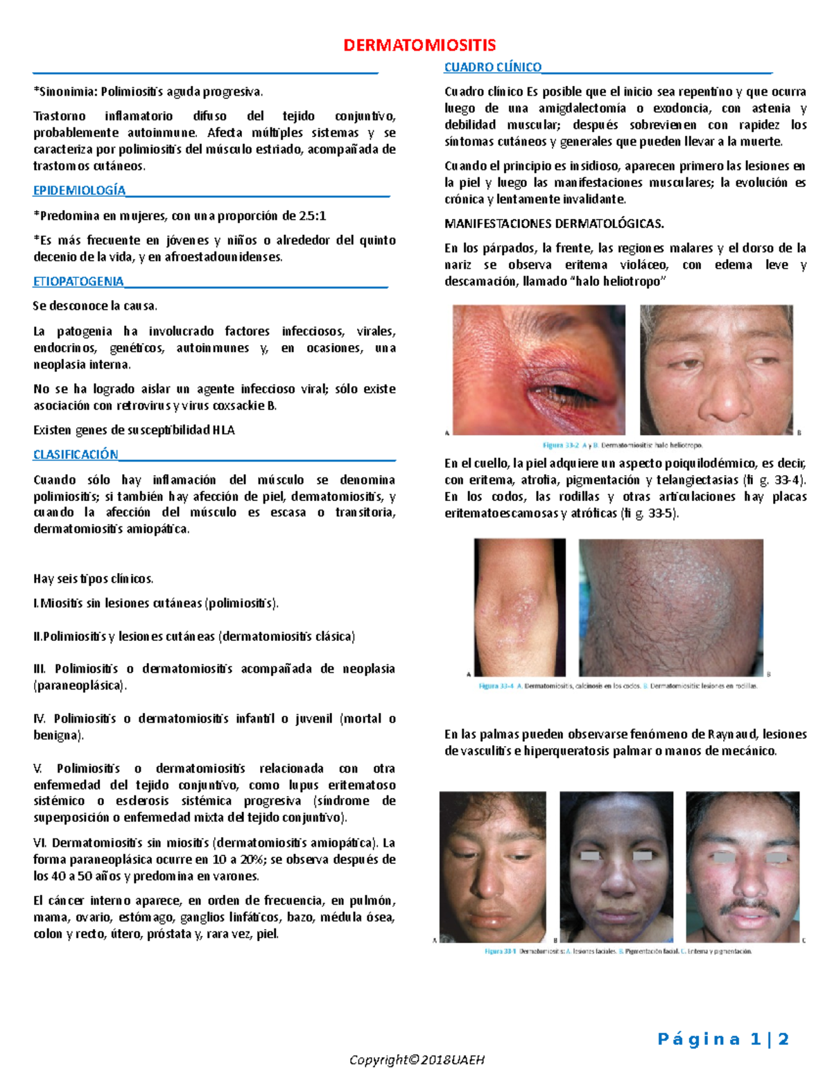 Dermatomiositis - Resumen Dermatología - DERMATOMIOSITIS Polimiositis ...