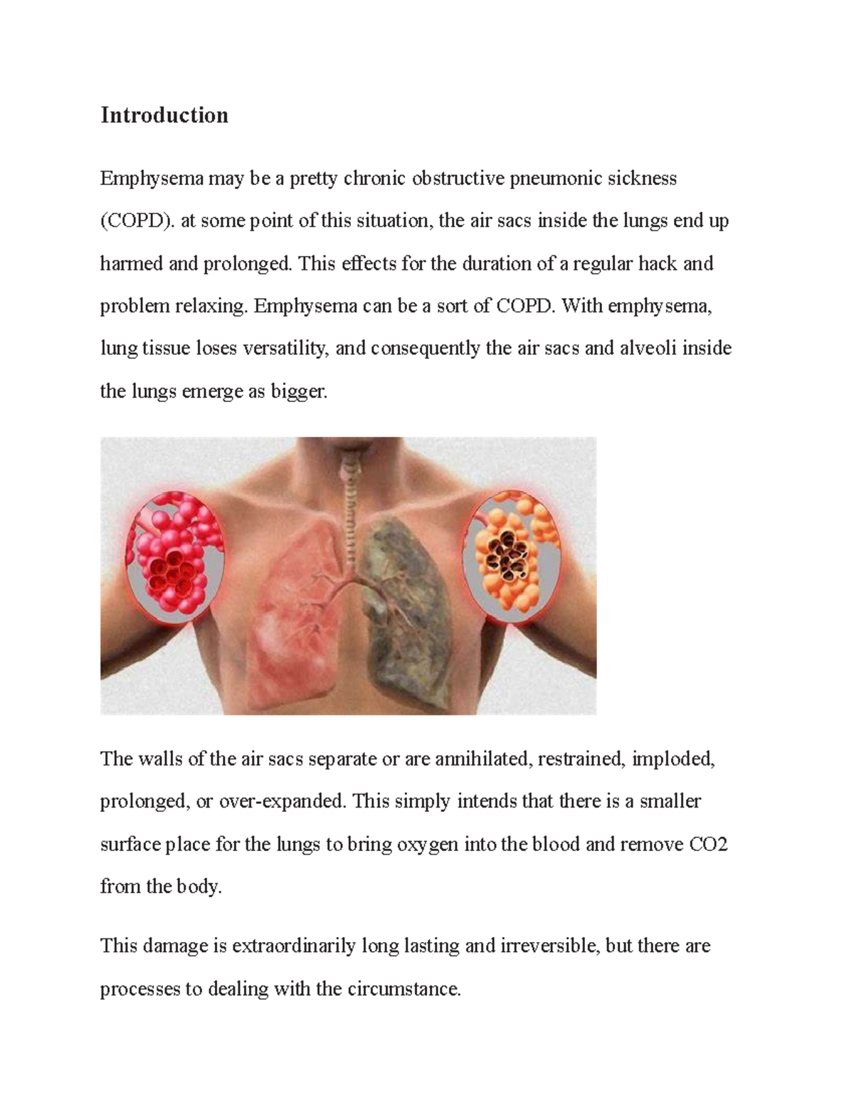 Emphysema - Introduction Emphysema may be a pretty chronic obstructive ...