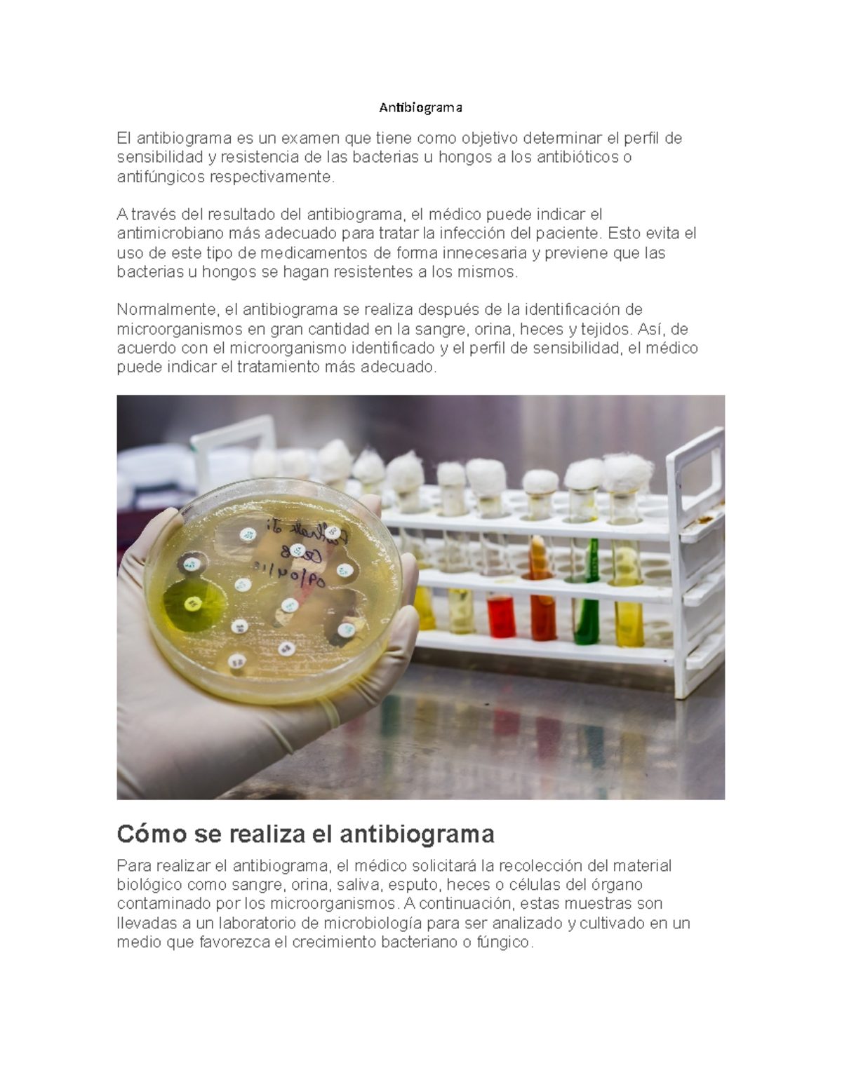 Antibiograma - A través del resultado del antibiograma, el médico puede ...