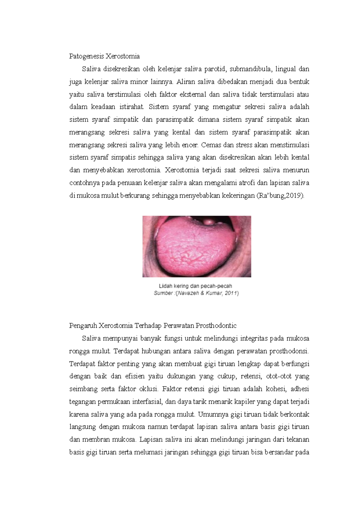 Dentistry - Xerostomia - Patogenesis Xerostomia Saliva disekresikan oleh kelenjar saliva parotid ...