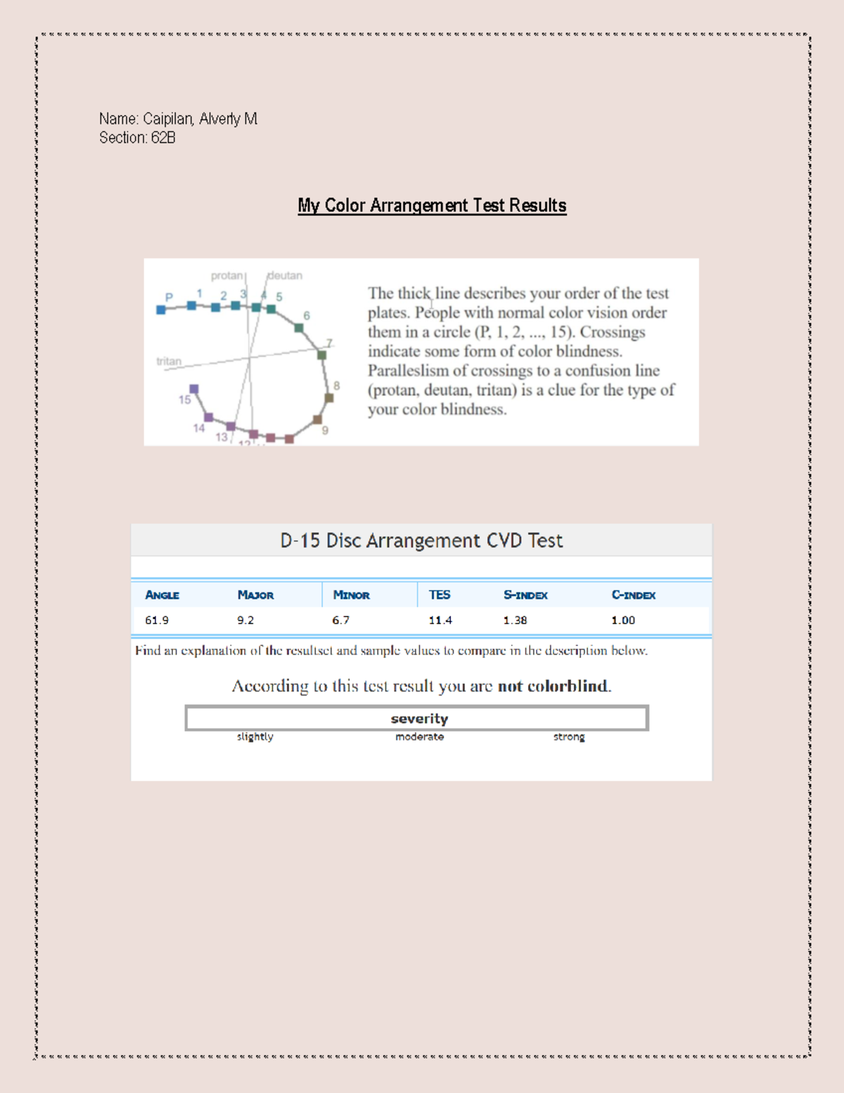 My Color Arrangement Test Results - Doctor of Optometry - Name ...