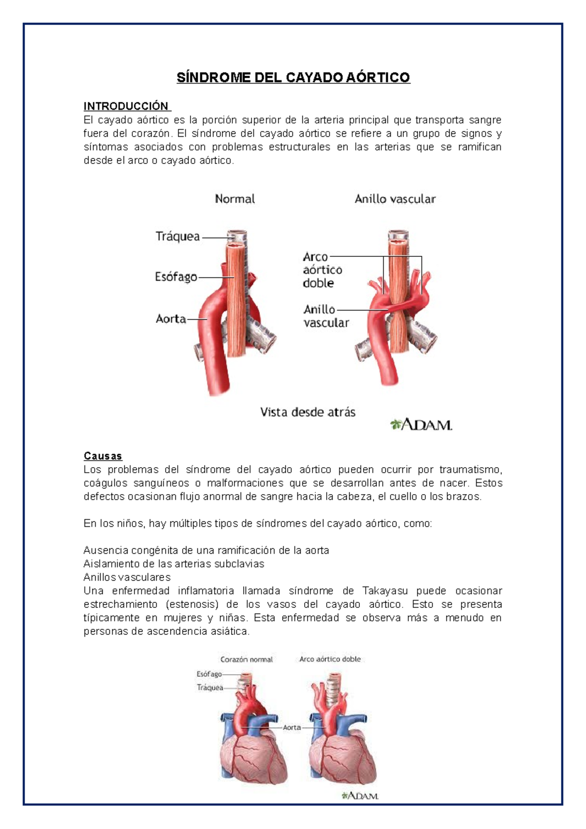 Síndrome DEL Cayado Aórtico - SÍNDROME DEL CAYADO AÓRTICO INTRODUCCIÓN ...