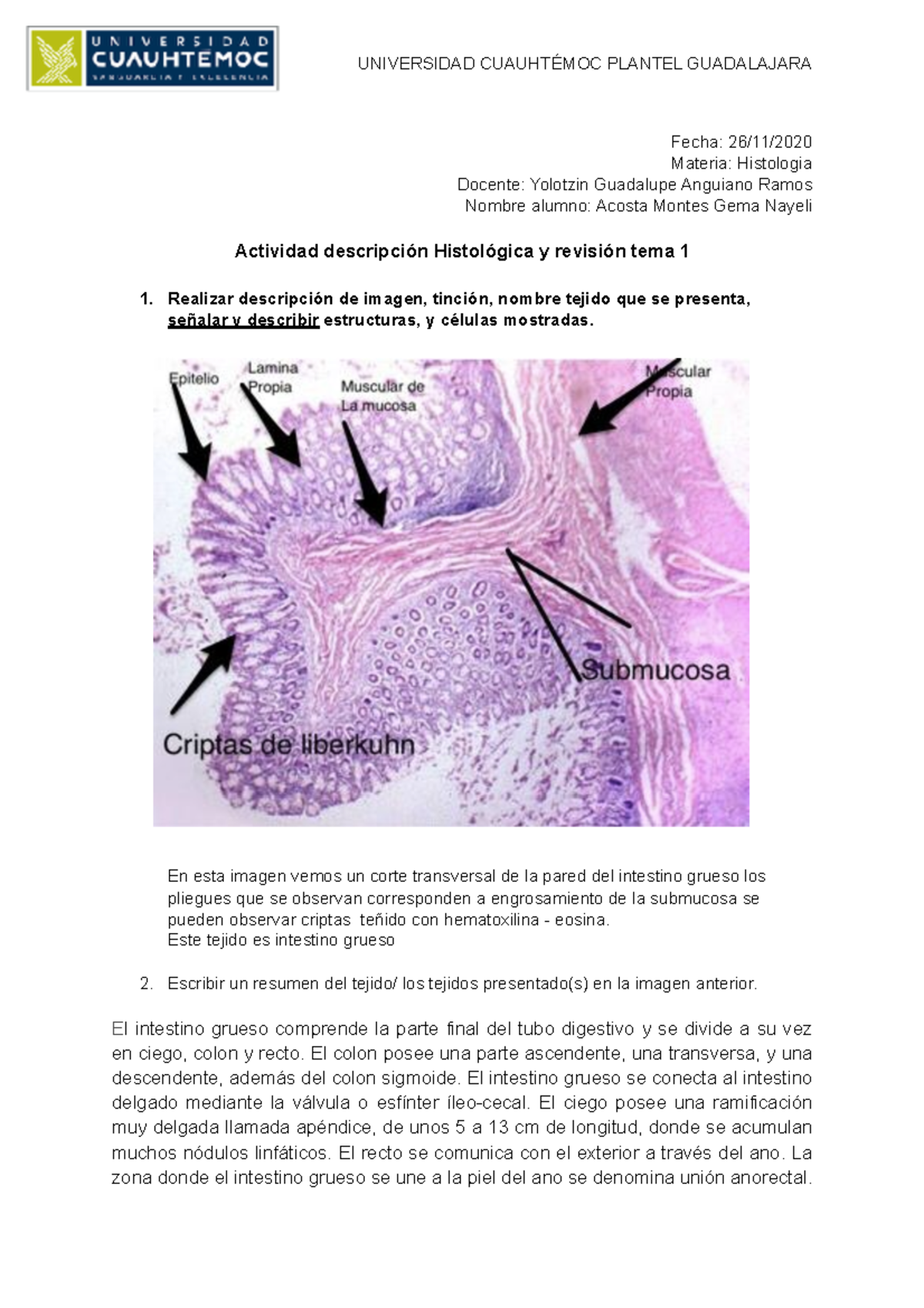 Actividad histologica - UNIVERSIDAD CUAUHTÉMOC PLANTEL GUADALAJARA ...