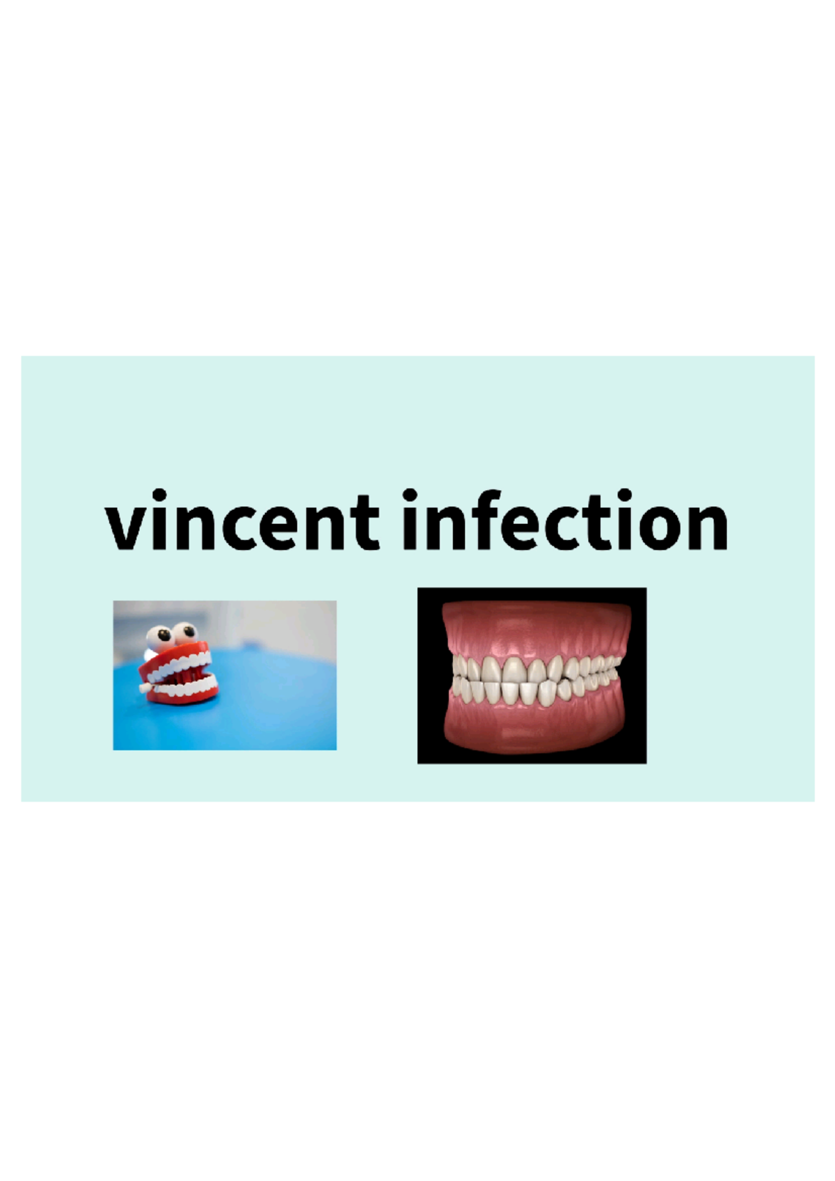Vincent infection - VINCENT DISEASE acute necrotizing ulcerative ...