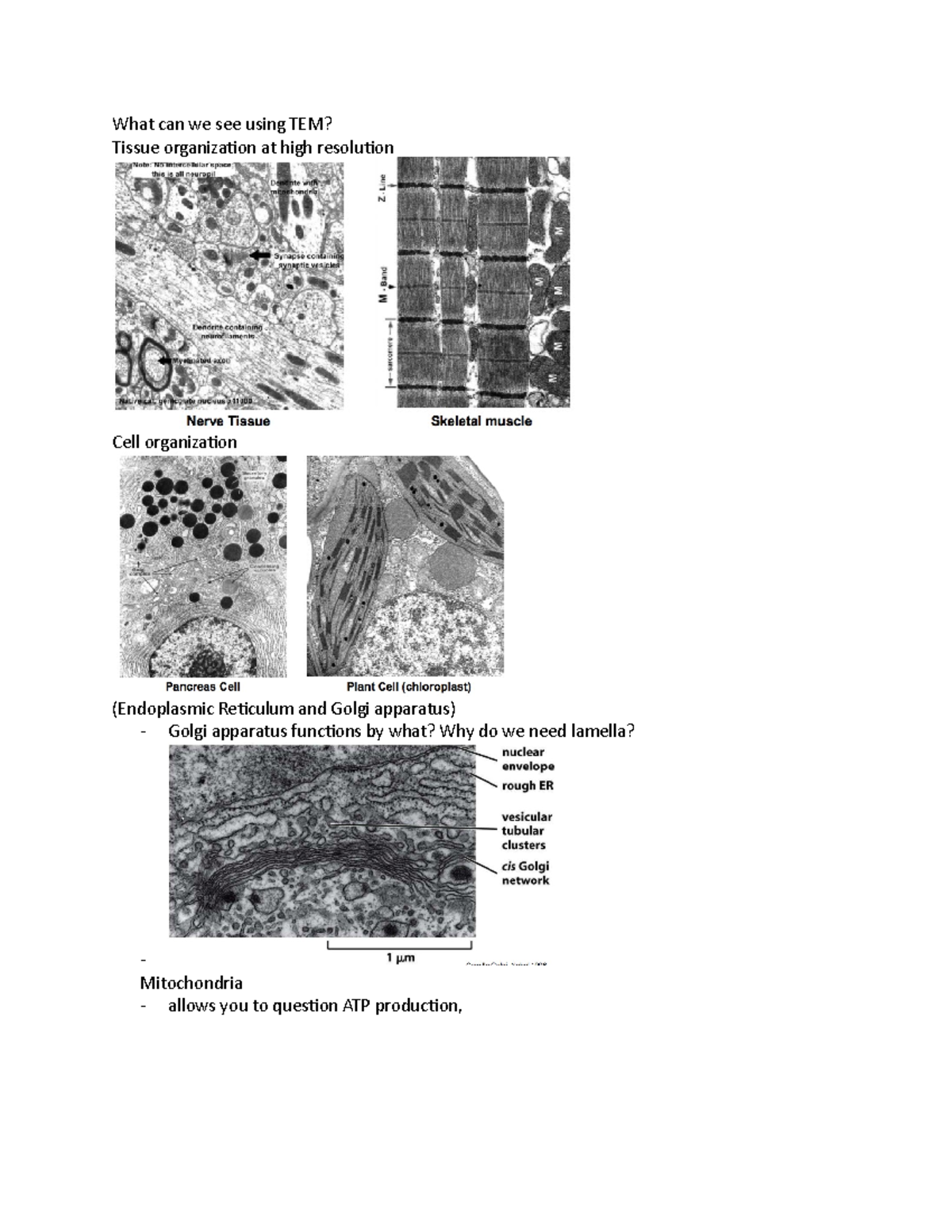 Electron Microscopy - Lecture notes - What can we see using TEM? Tissue ...