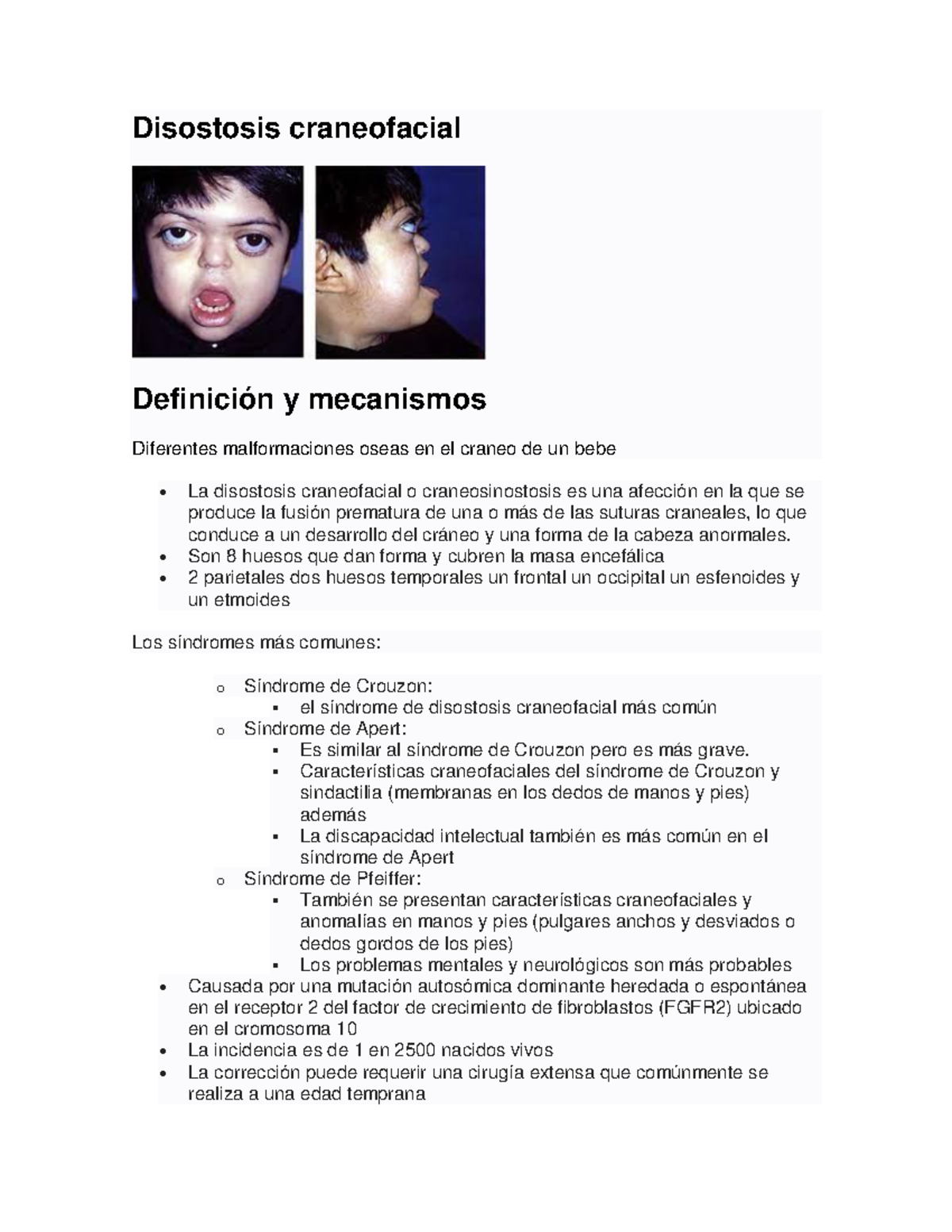 Disostosis craneofacial - Son 8 huesos que dan forma y cubren la masa ...