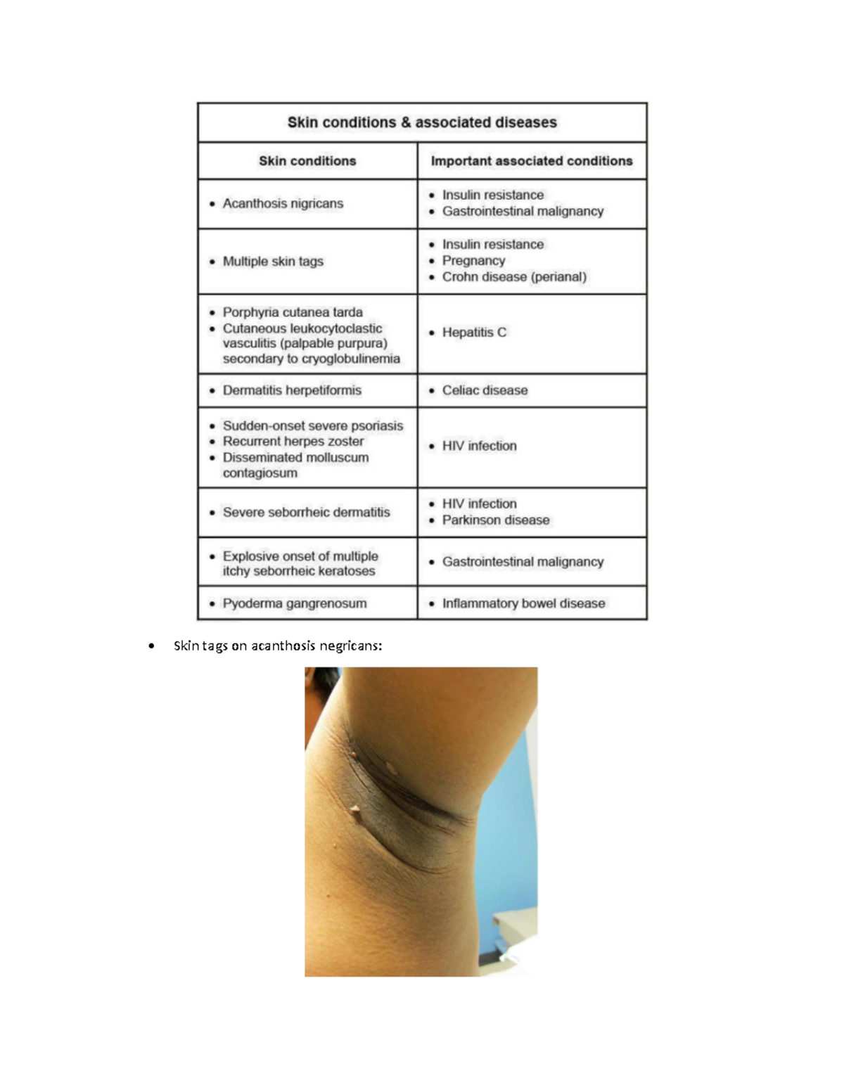 Derm - derma summery - Skin tags on acanthosis negricans: Actinic ...