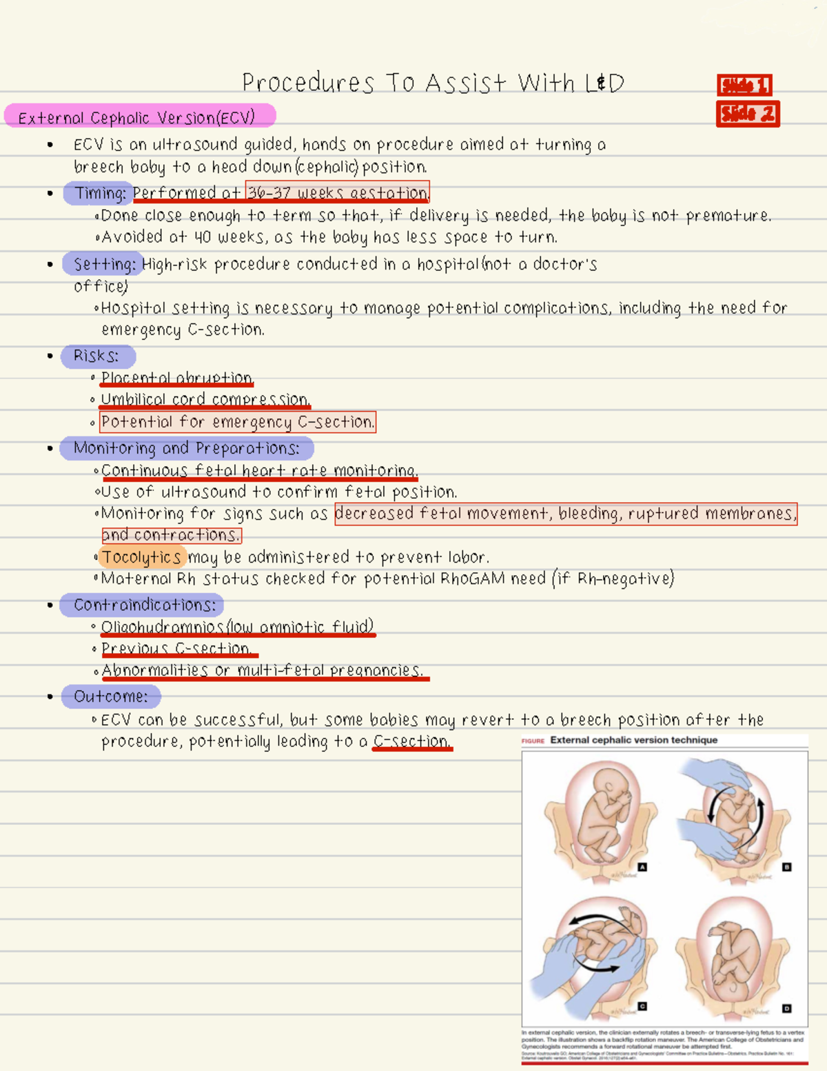 Therapeutic Procedures to Assist with Labor and Delivery - Procedures ...