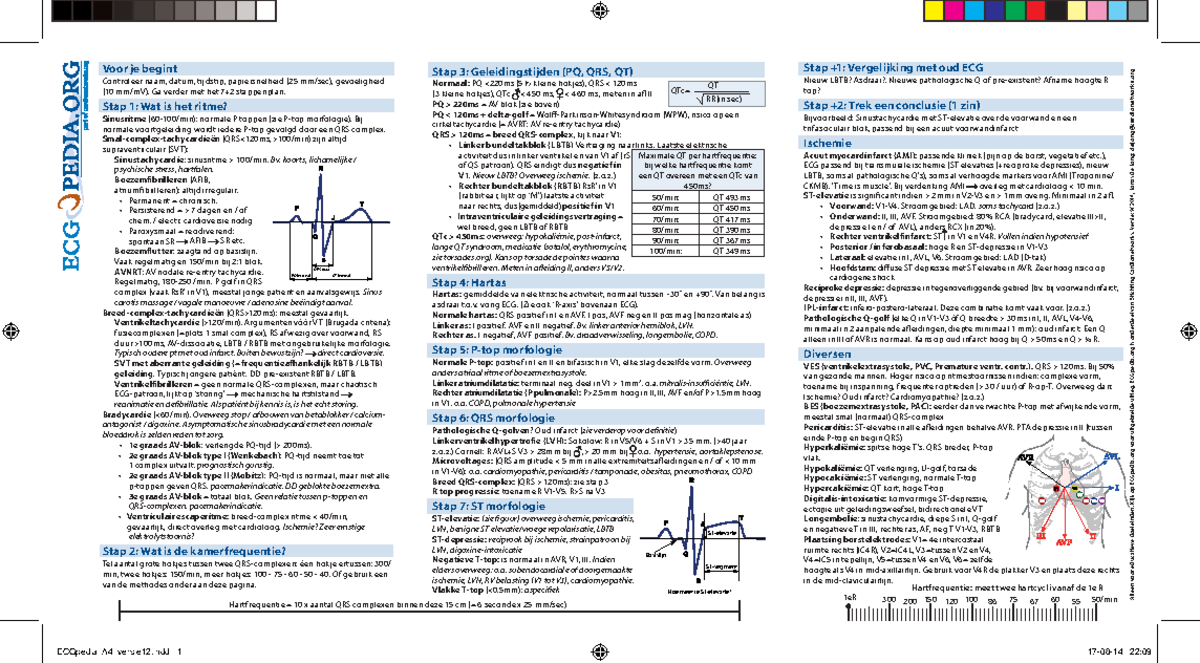 ECGpedia op 1 A4 - ecg - Voor je begint Controleer naam, datum, tijdstip, papiersnelheid (25 ...