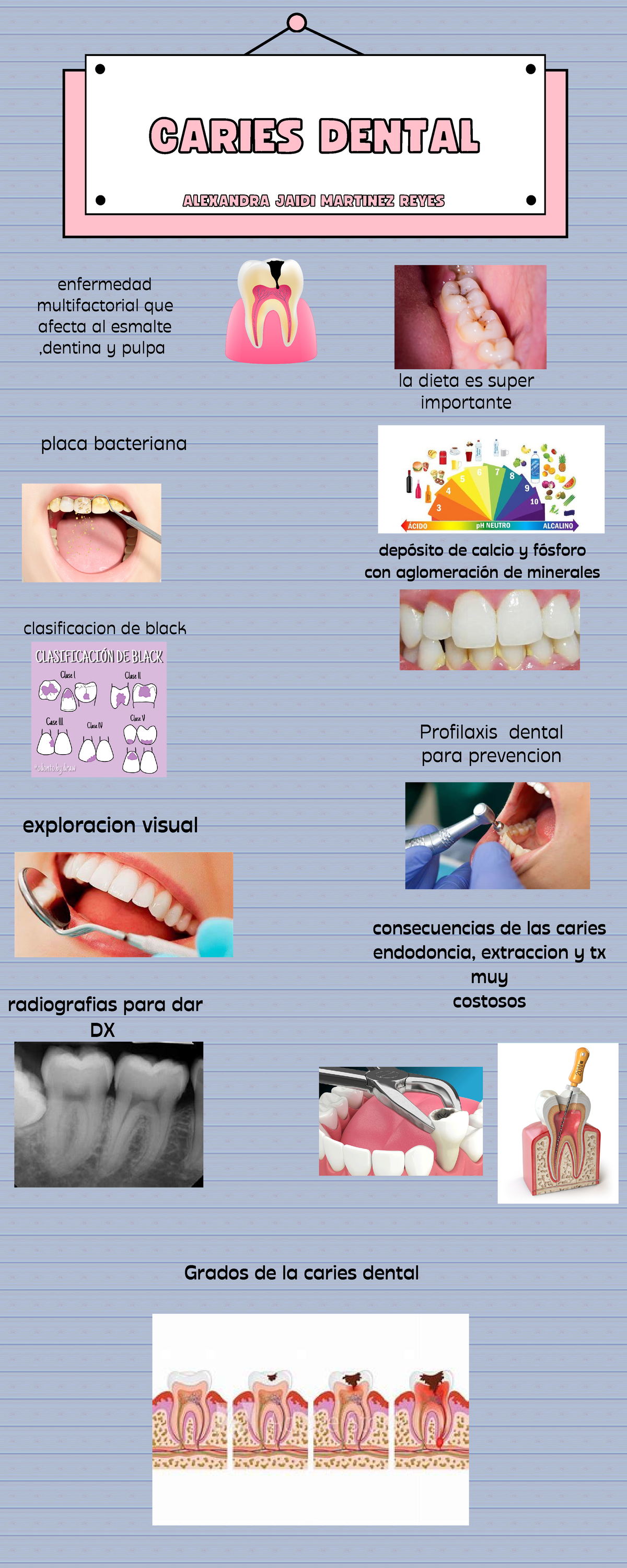 Infografia de la Caries - CARIES DENTALCARIES DENTAL enfermedad ...