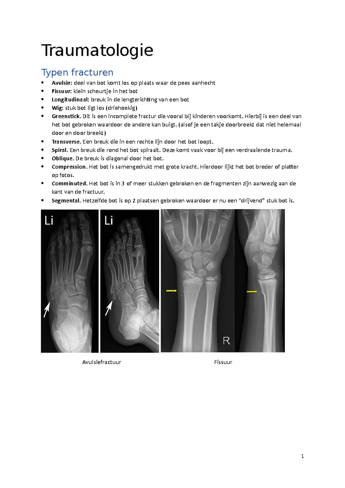 Traumatologie type botfracturen en classificaties - Traumatologie Typen ...