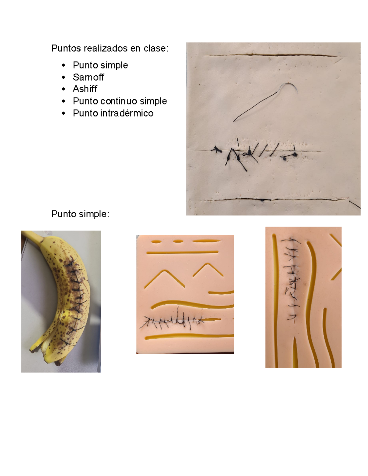 Fotos de suturas - Cirugia - Puntos realizados en clase: Punto simple ...
