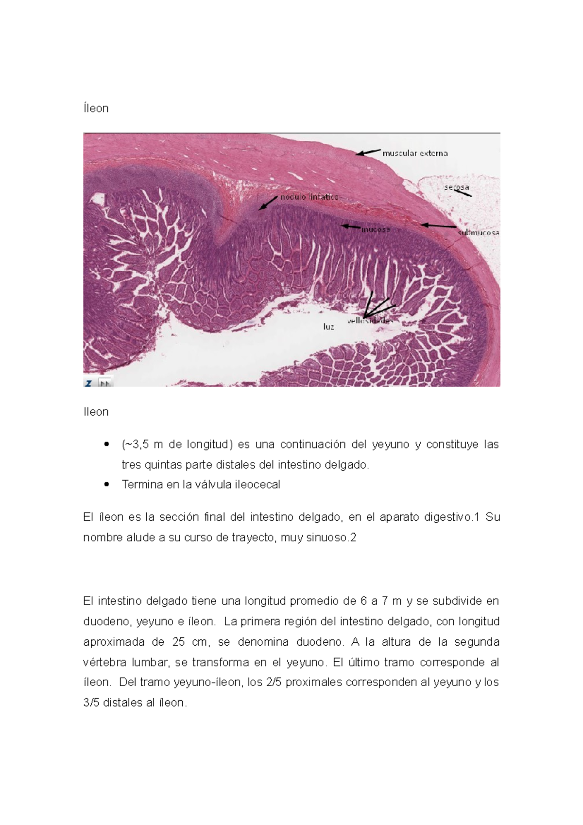 Íleon-peyer patch - Íleon Ileon (~3,5 m de longitud) es una ...