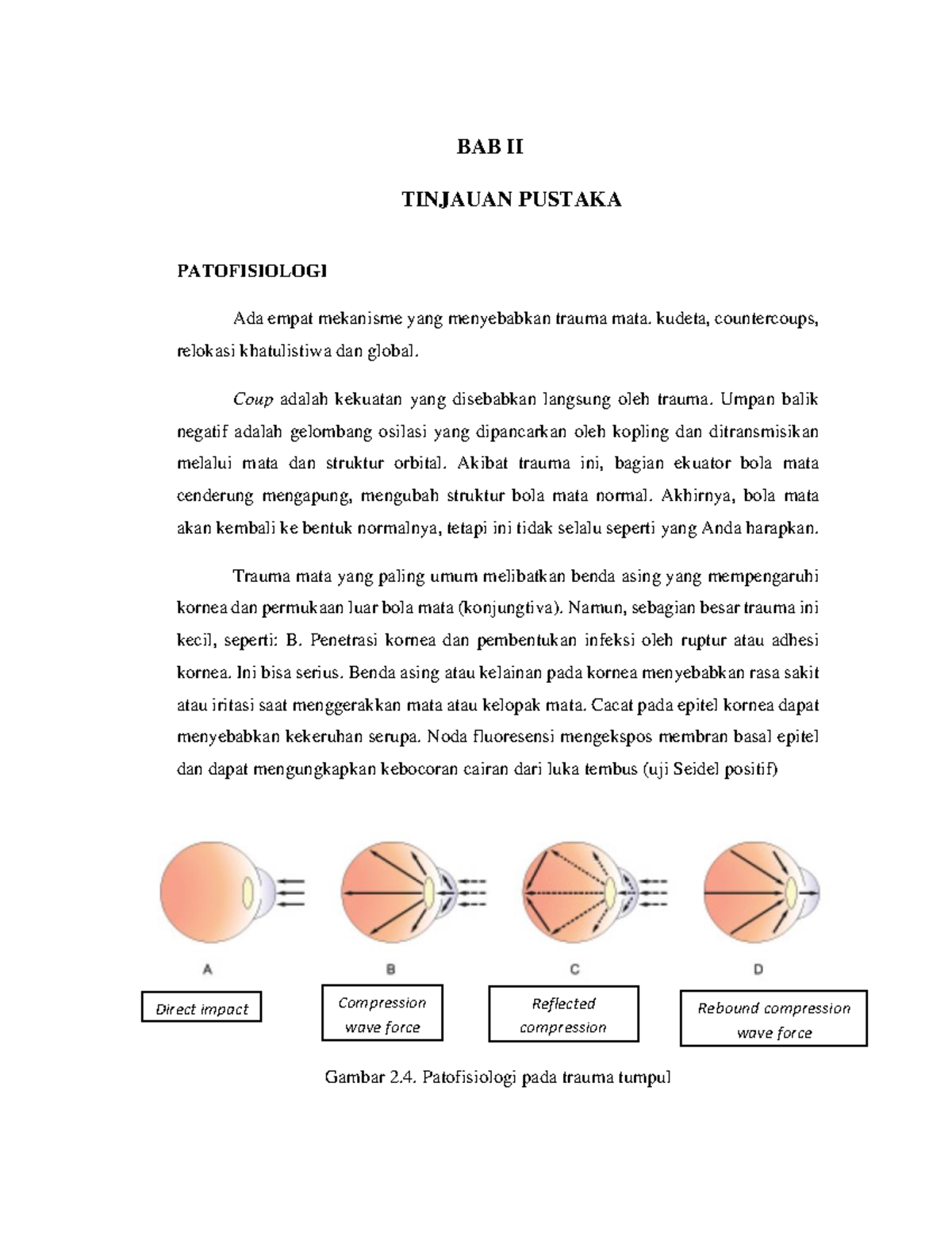 Trauma Okuli - Patofisiologi - Direct impact Compression wave force ...