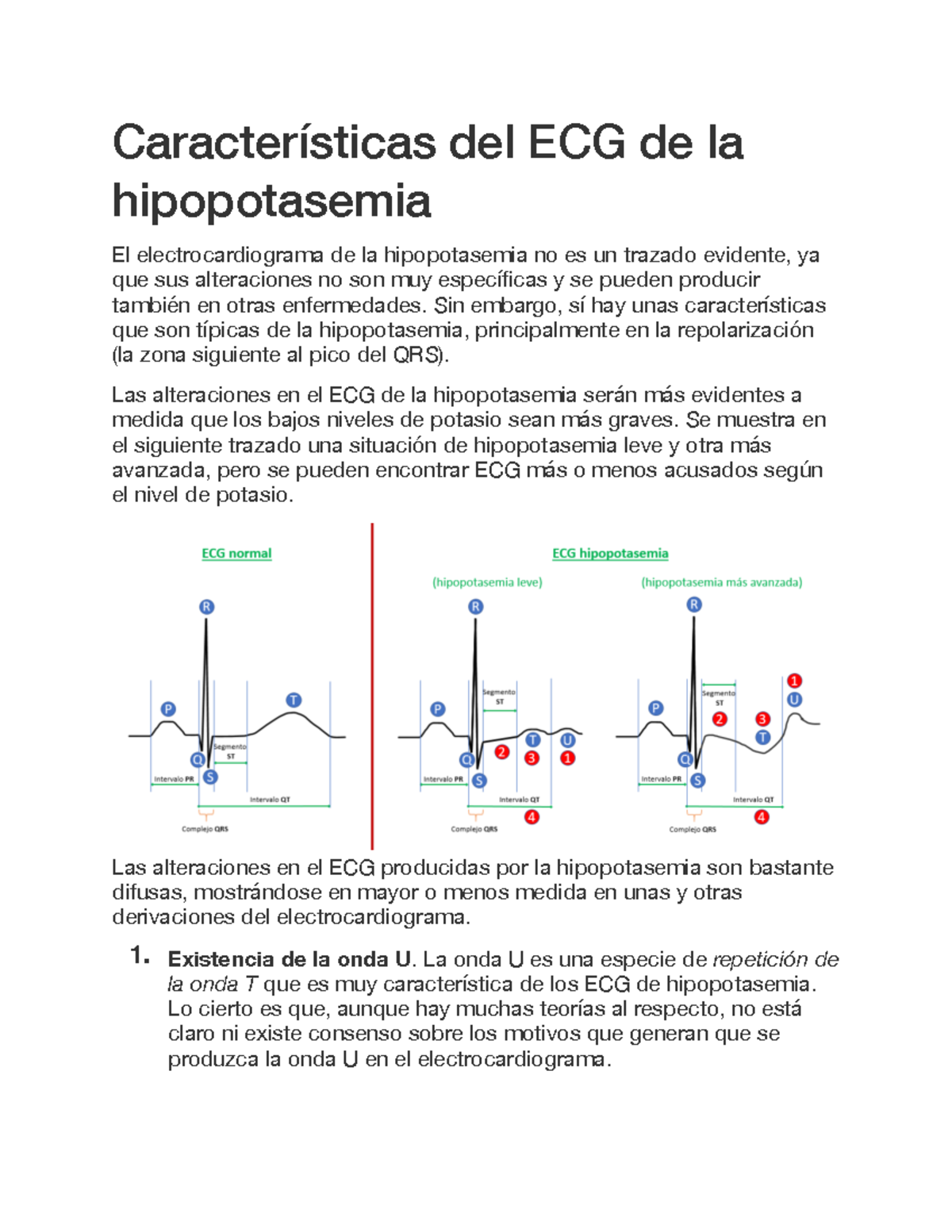 Ekg hipokalemia - Características del ECG de la hipopotasemia El electrocardiograma de la - Studocu