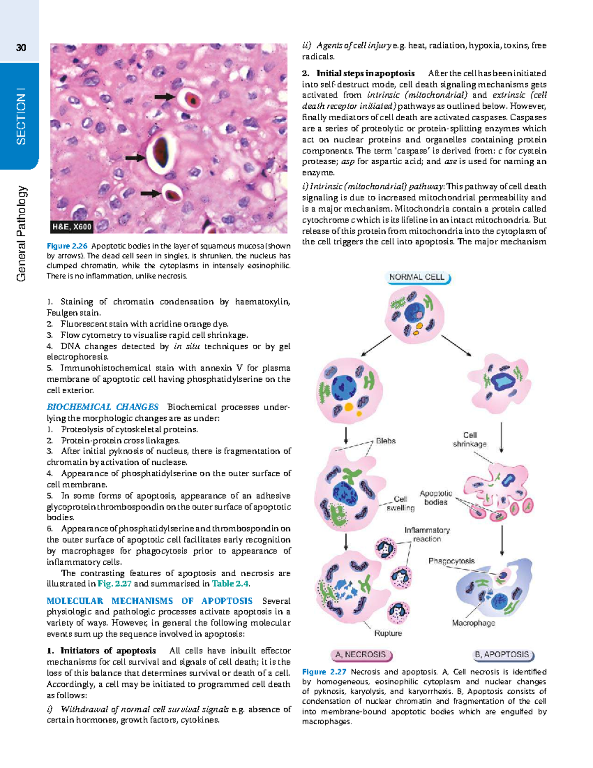 Harsh Mohan Textbook of Pathology, 7th edition-6 - 30 General Pathology ...
