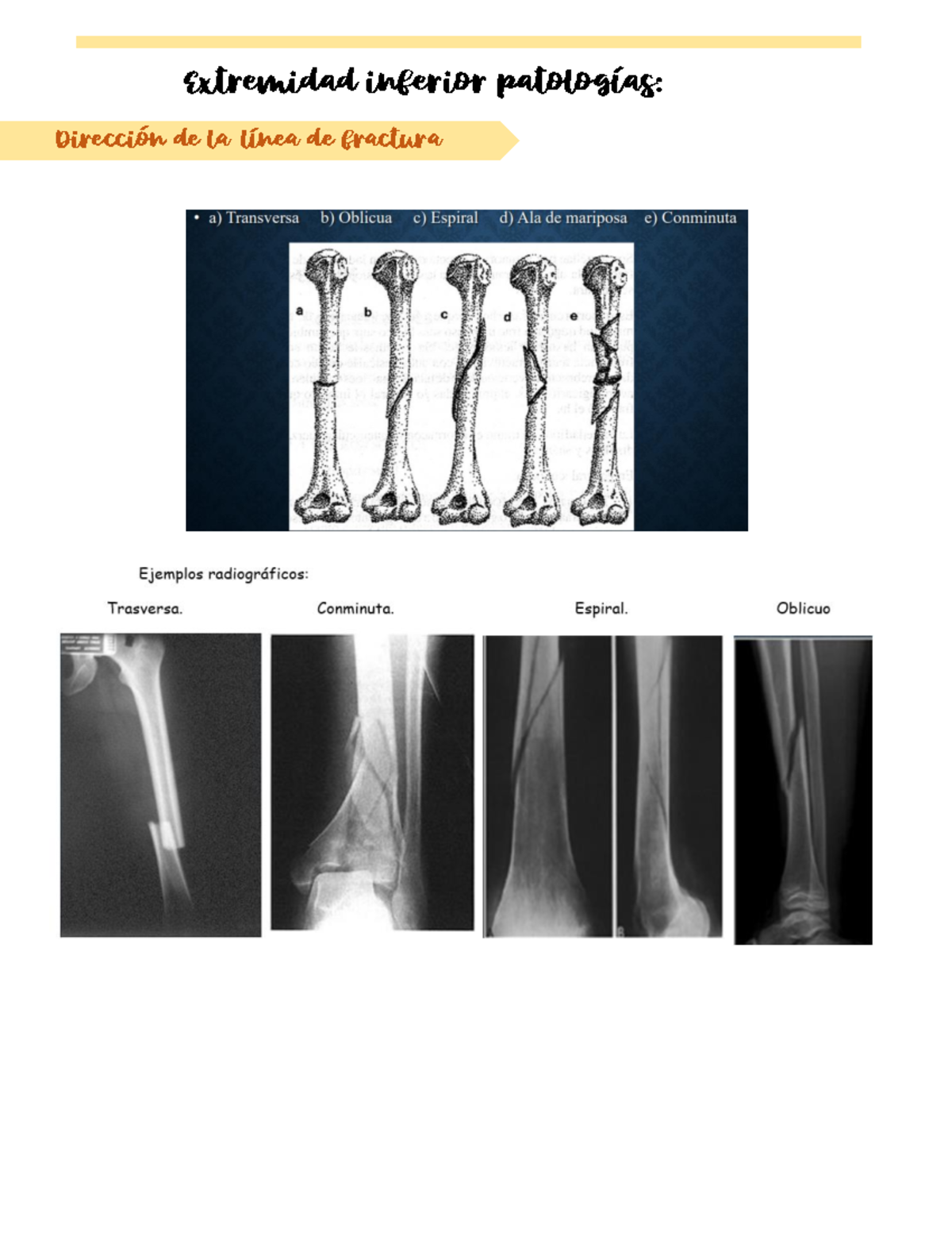 Extremidad inferior patologías - Extremidad inferior patologías ...
