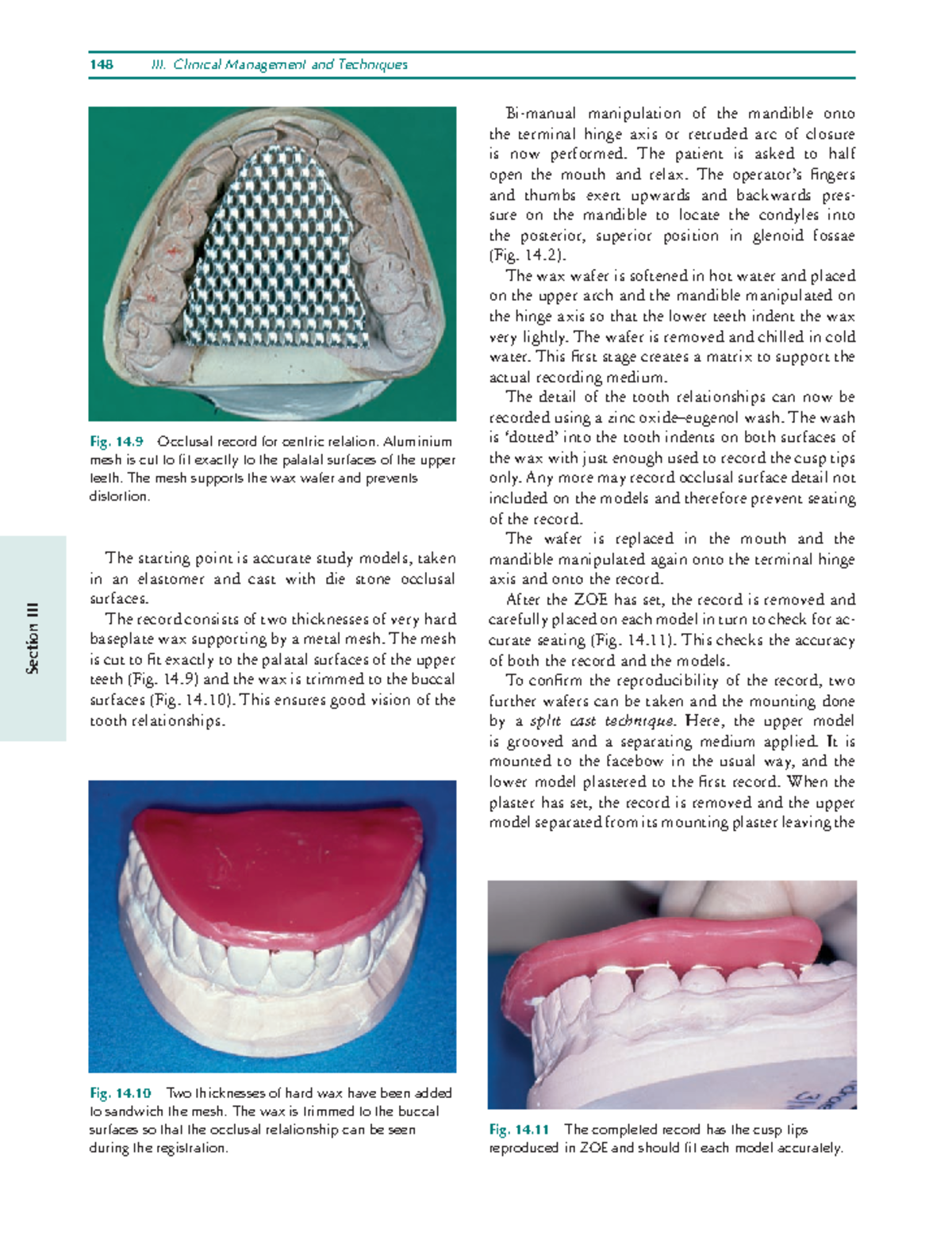 Restorative Dentistry an Integrated Approach-17 - 148 III. Clinical ...