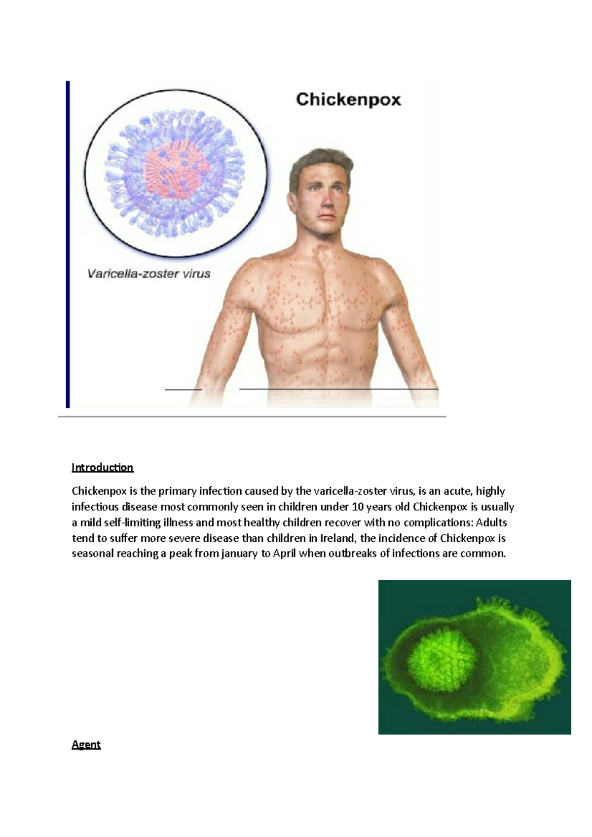 Short note on Chickenpox - Introduction Chickenpox is the primary ...