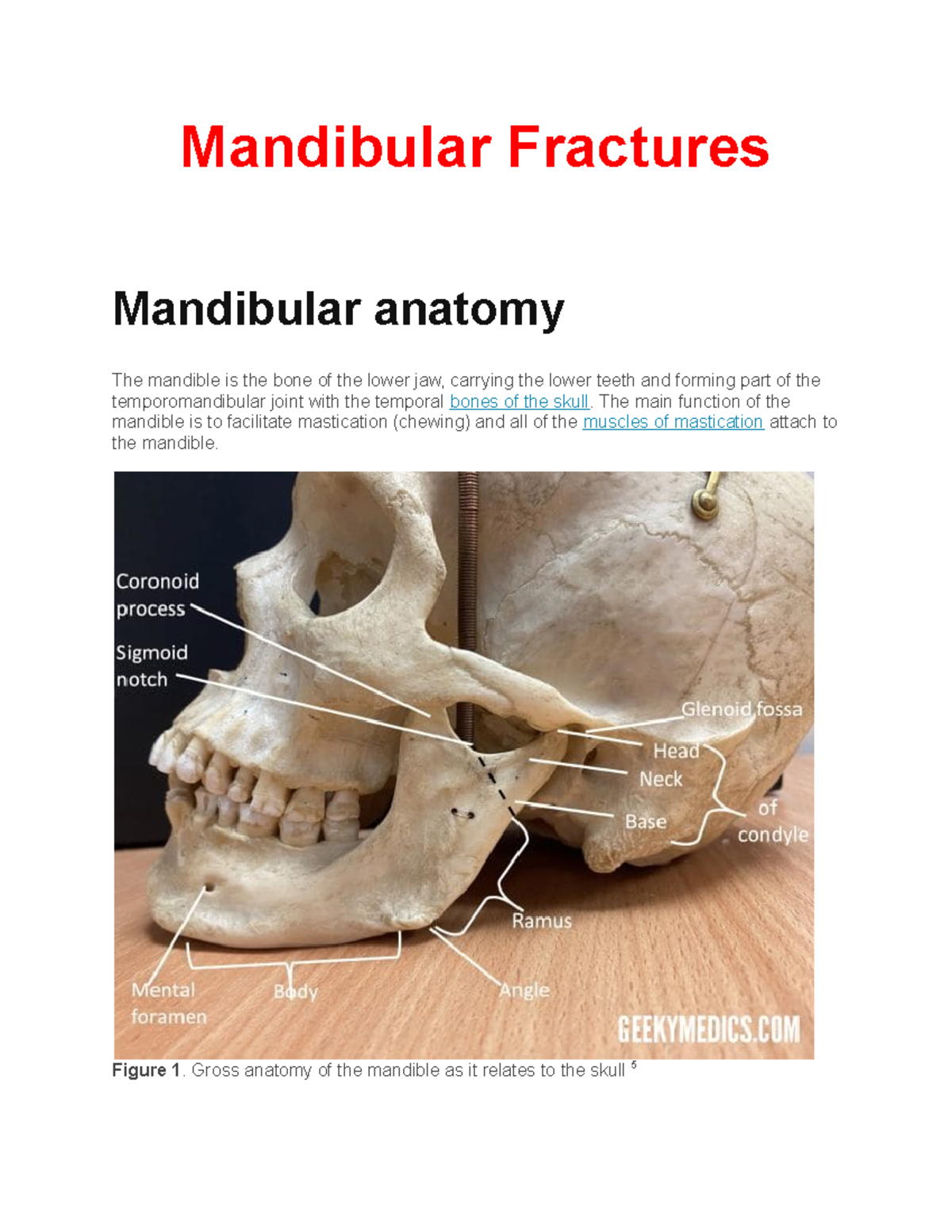 Nursing -Mandibular Fractures - Mandibular Fractures Mandibular anatomy ...