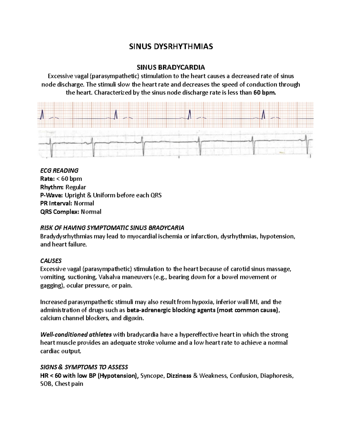 Dysrhythmia Nursing Interventions 5 - SINUS DYSRHYTHMIAS SINUS ...