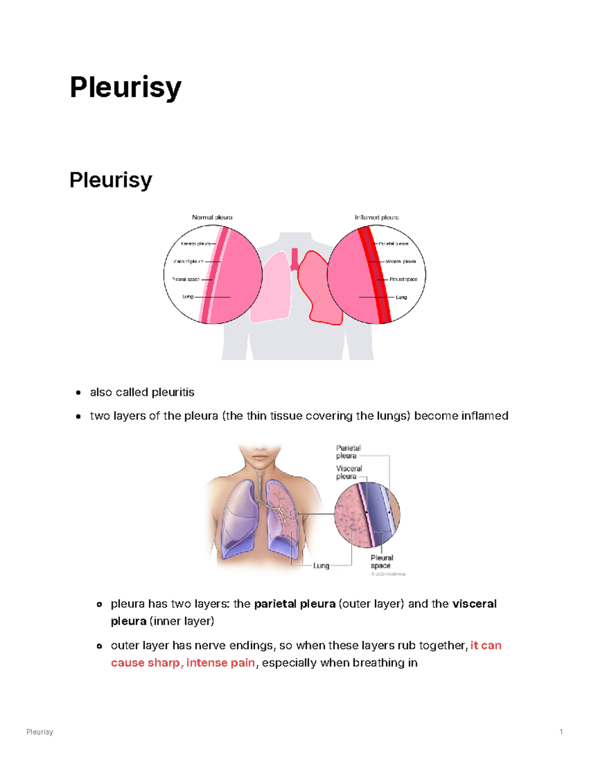 Pleurisy - Notes - Pleurisy Pleurisy also called pleuritis two layers ...