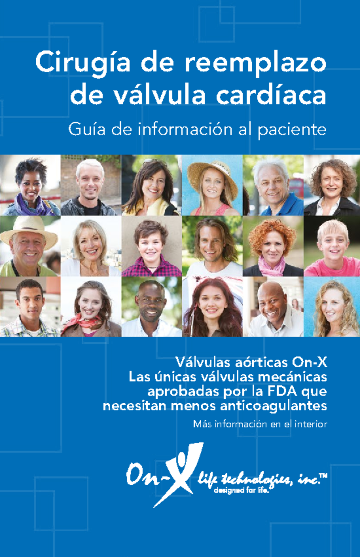 Guia de paciente on x - Guia - Cirugía de reemplazo de válvula cardíaca ...