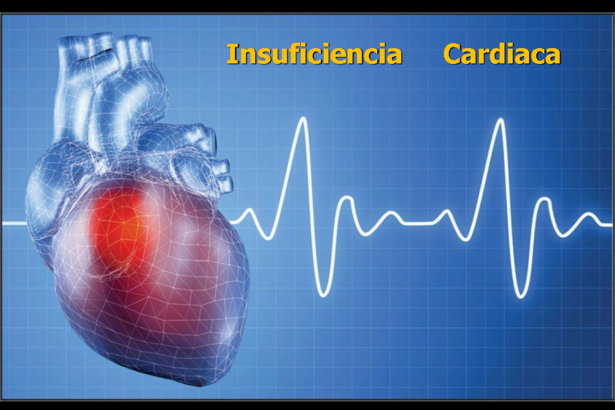 Insuficiencia cardiaca (ppt de fisiopatología cardíaca) - ALBERT ...