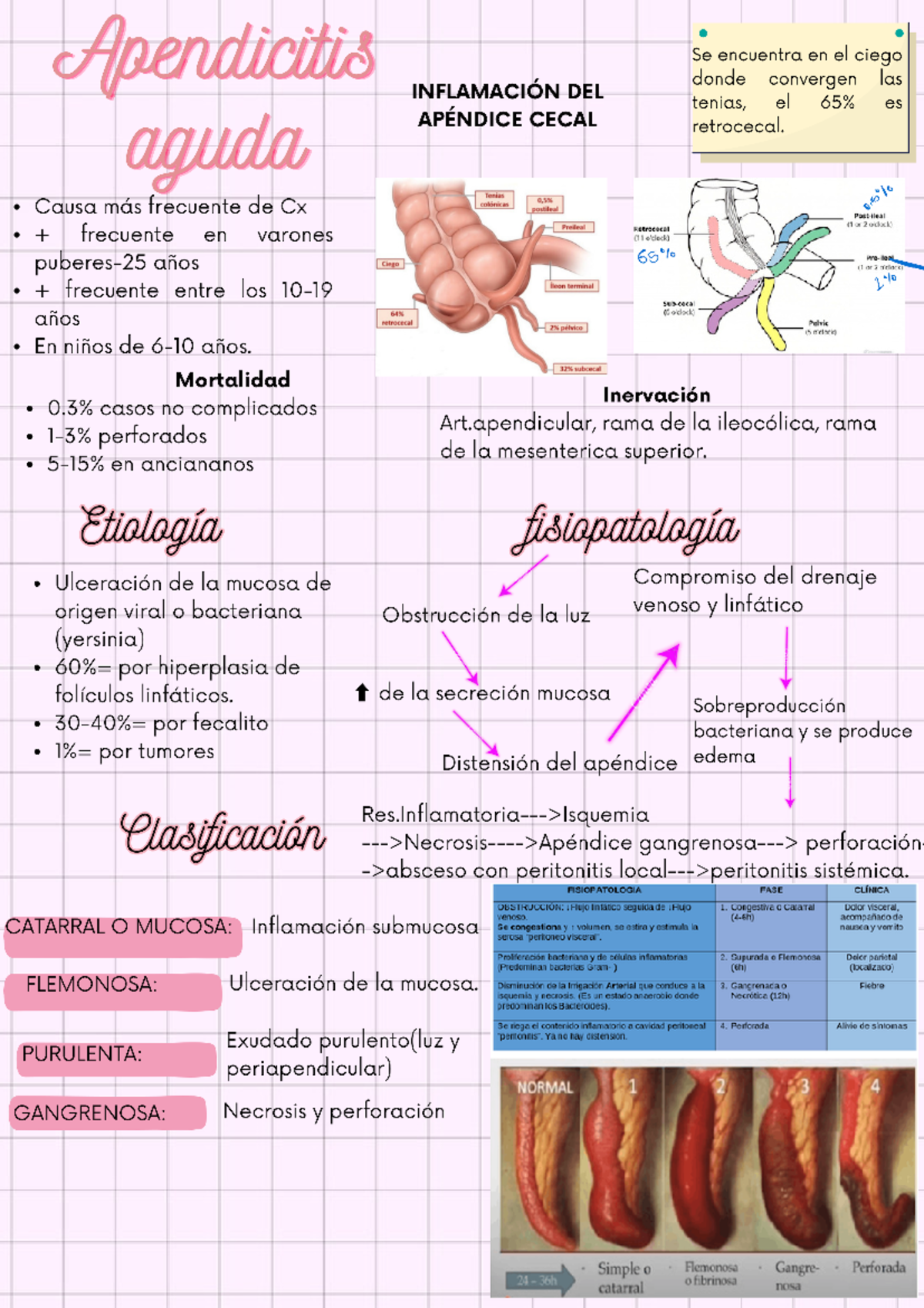 Apendicitis Aguda 20240326 102726 0000 - Gastroenterologia - Studocu