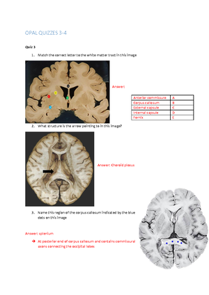 Neuroanatomy of Vision - 300754 - Neuroanatomy Of Vision Neuroanatomy ...
