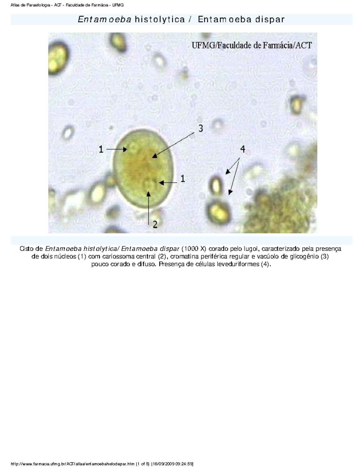 Entamoeba histolytica + Entamoeba dispar - En t a m o e b a h i s t o l ...