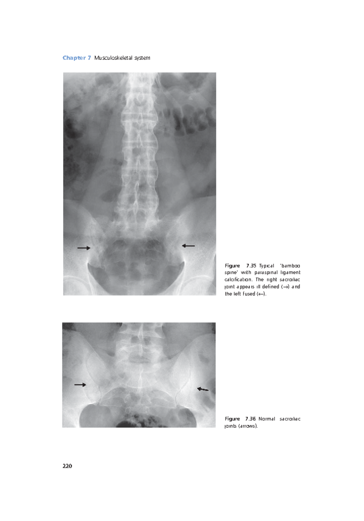 Radiology Lecture Notes pdf (74) - Chapter 7 Musculoskeletal system 220 ...