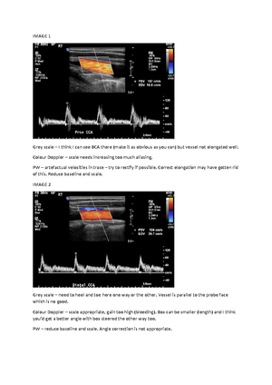 Sonographic terminology - echogram / sonogram Term used for an ...