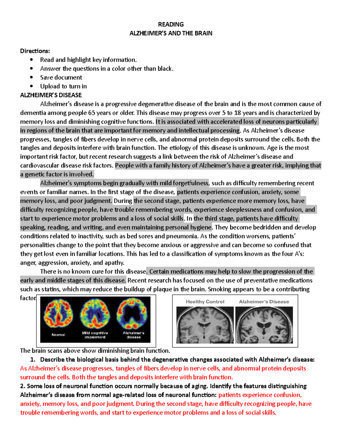 Reading Alzheimers and the Brain - READING ALZHEIMER’S AND THE BRAIN ...