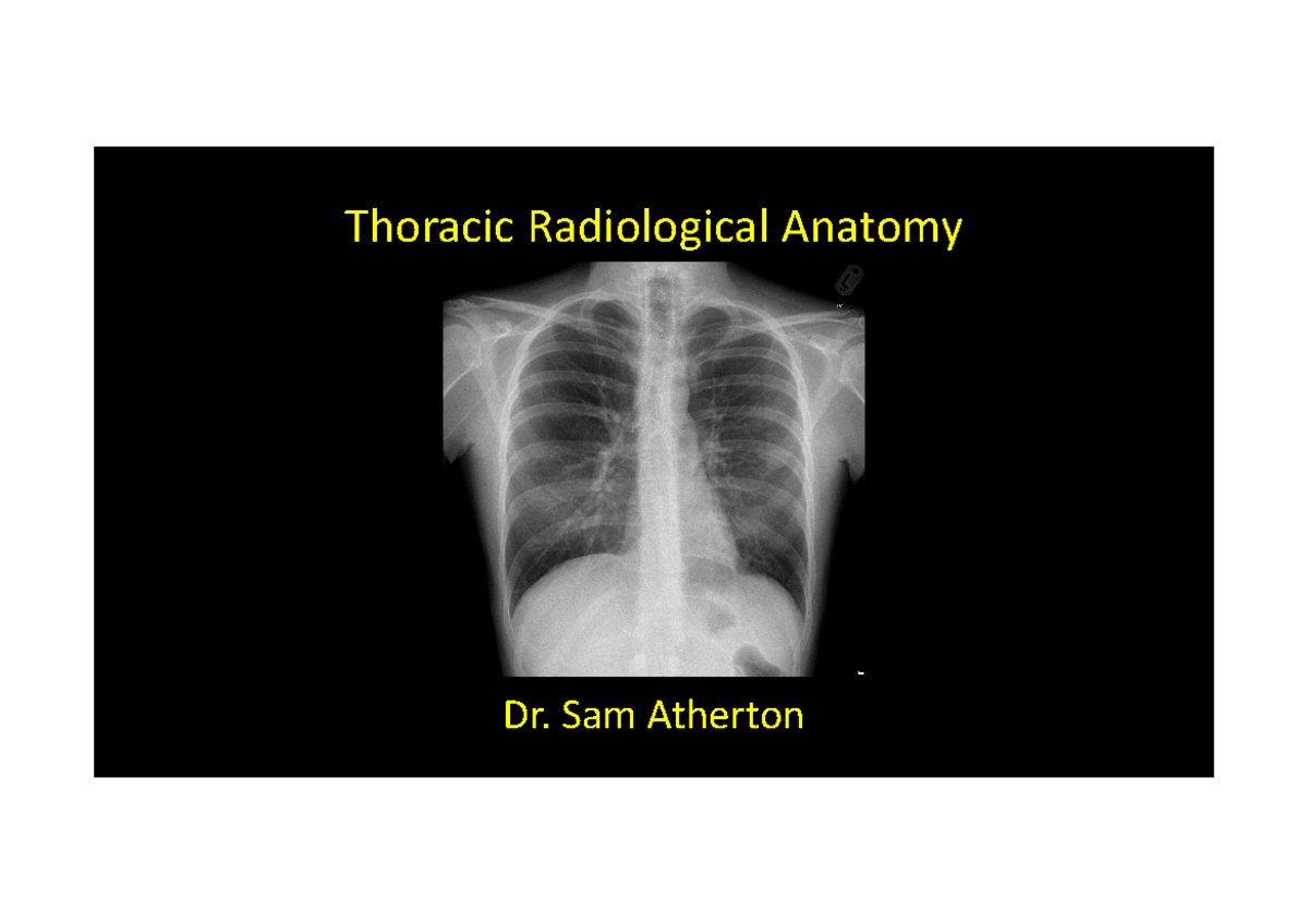 Thoracic radiological anatomy - Thoracic Radiological Anatomy Dr. Sam ...