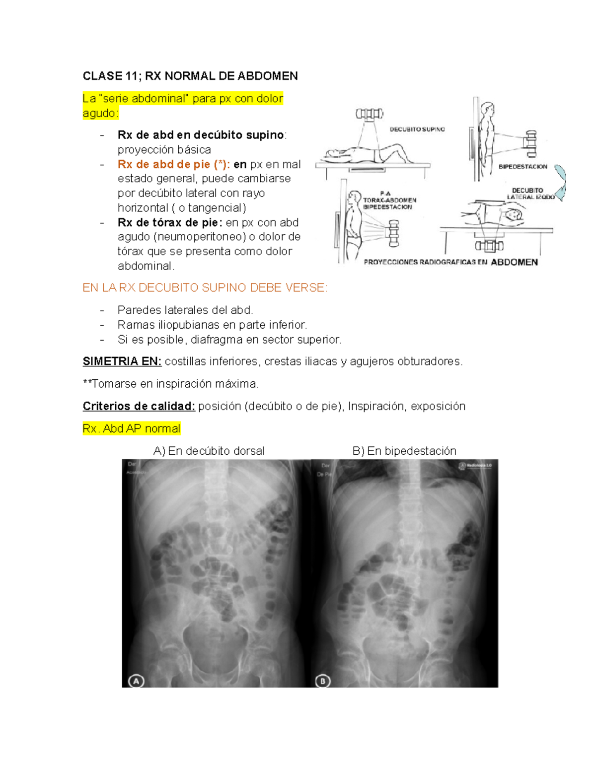 Radiografia DE Abdomen - CLASE 11; RX NORMAL DE ABDOMEN La “serie ...