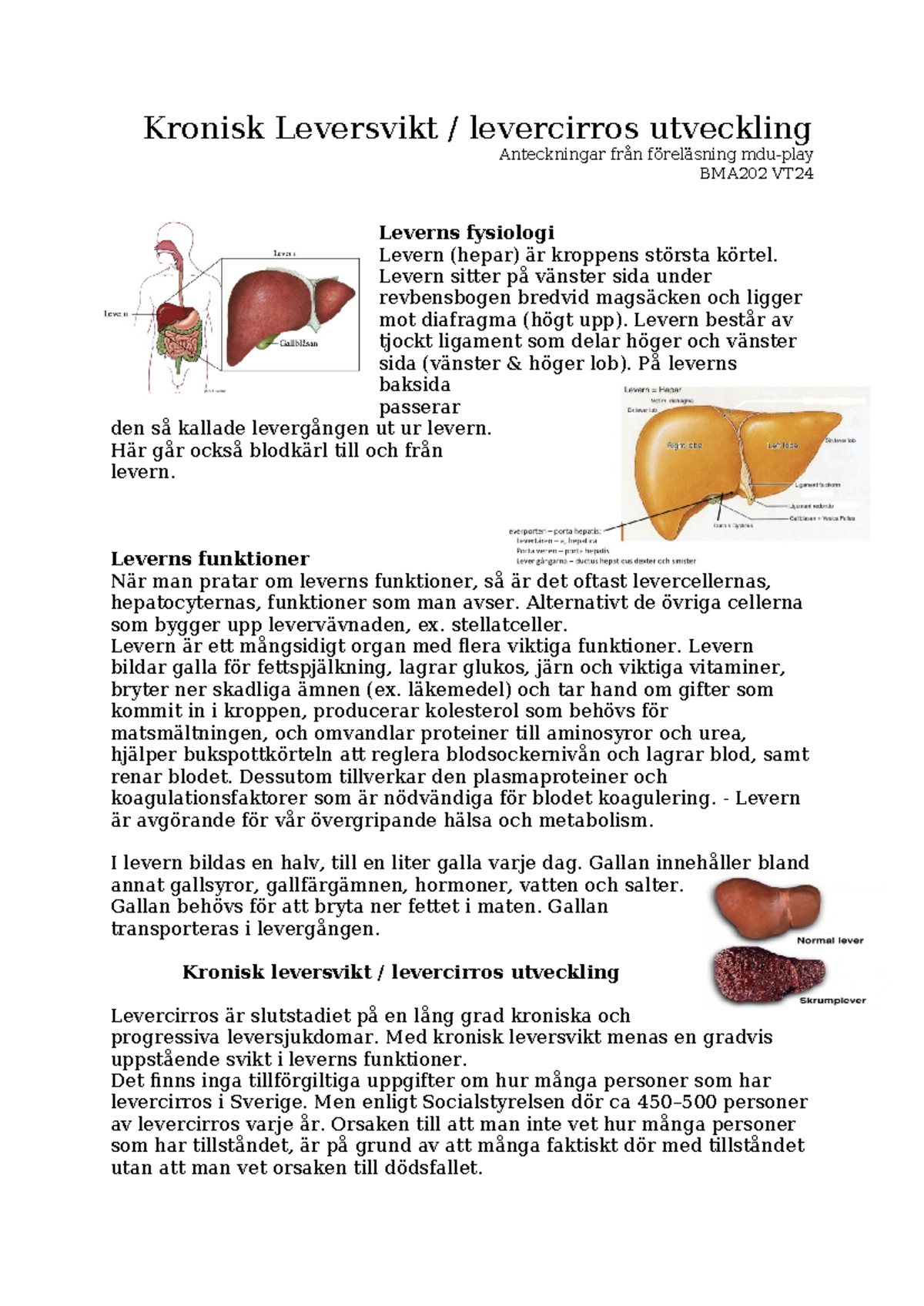 Lever sjukdomar - Kronisk Leversvikt / levercirros utveckling ...