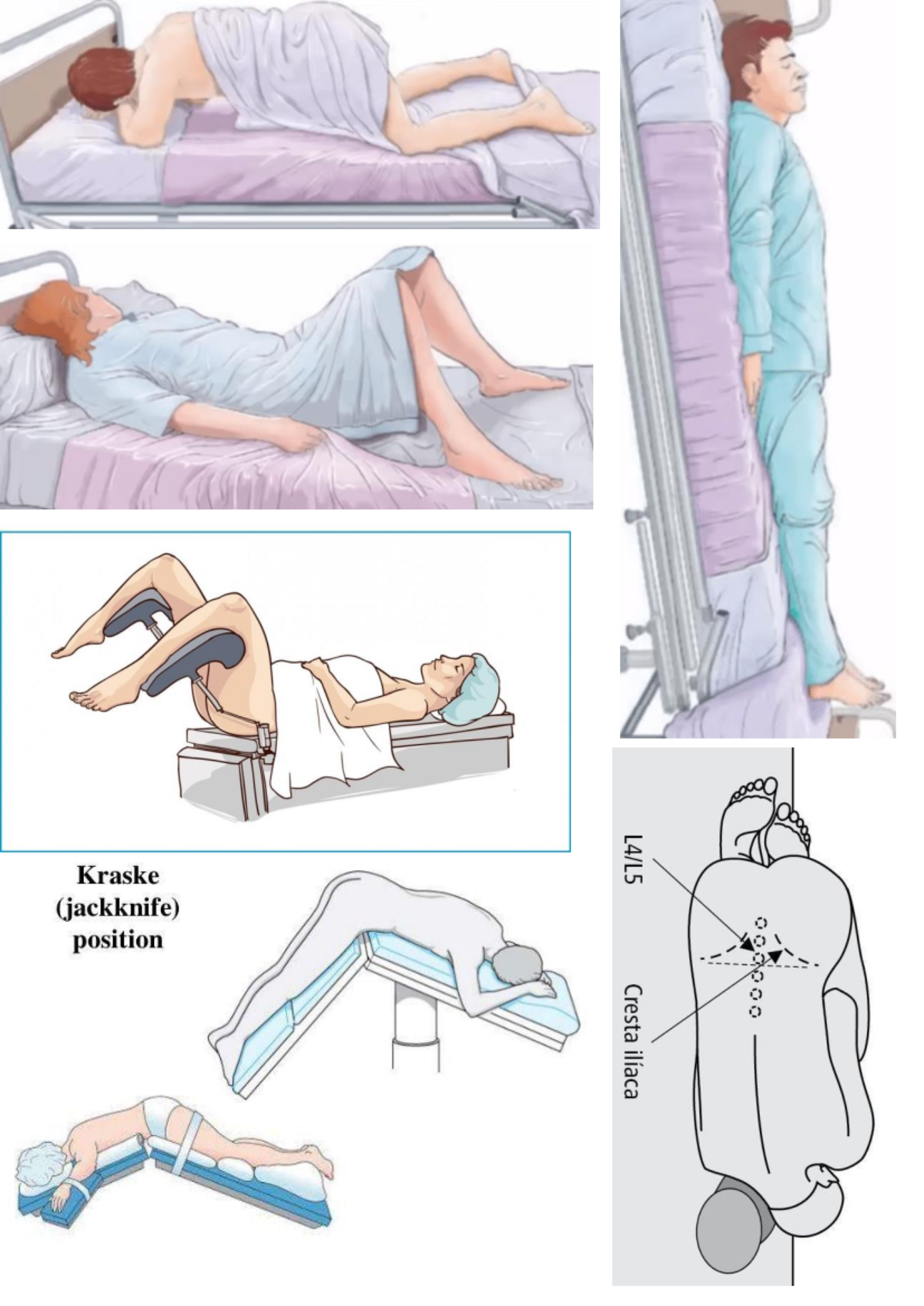 POSICIONES DE PACIENTES - enfermería - position position 1 2 3 4 5 6 1 ...