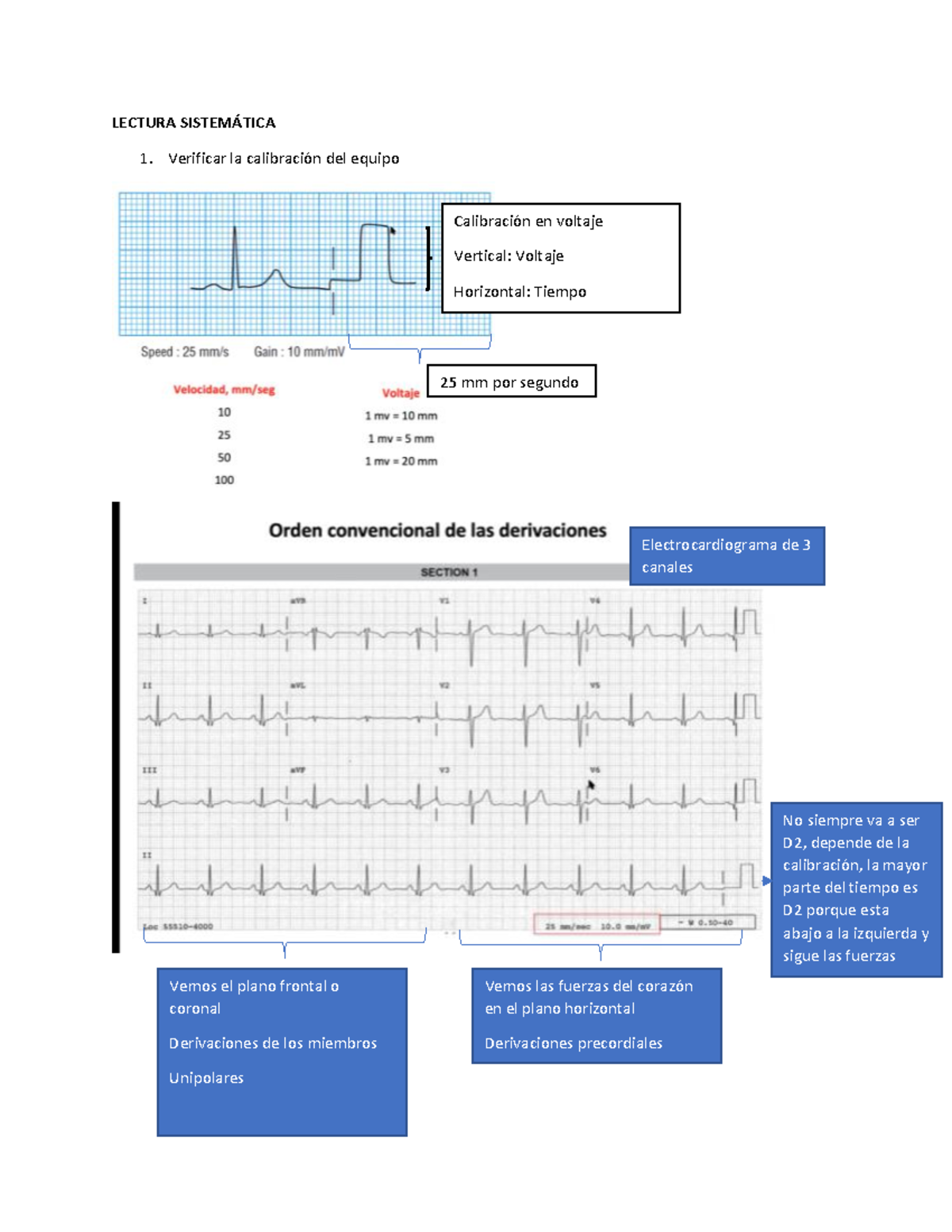 Lectura de un electrocardiograma normal - LECTURA SISTEMÁTICA Verificar ...